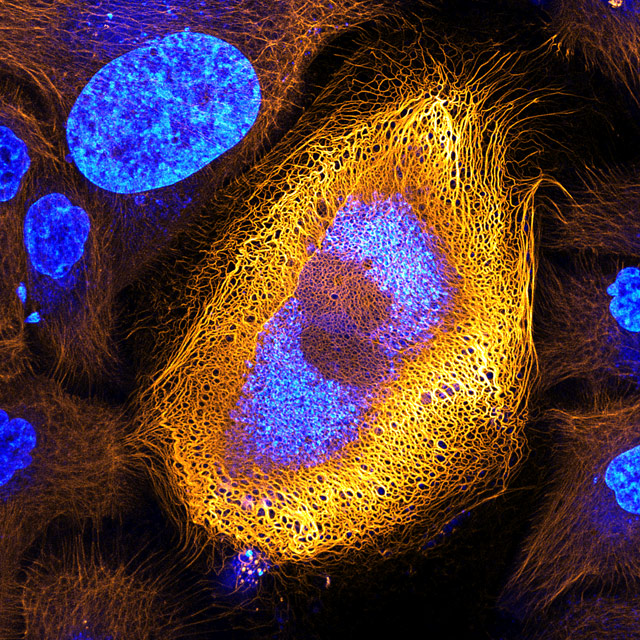Microscopic Cell Patterns Microscopic Cell Patterns
