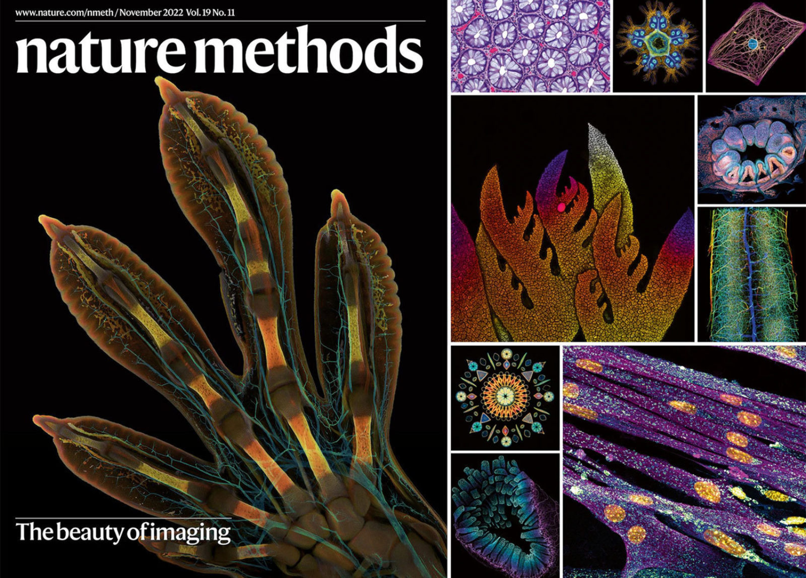 Nikon Small World in the Media | News | Nikon Small World