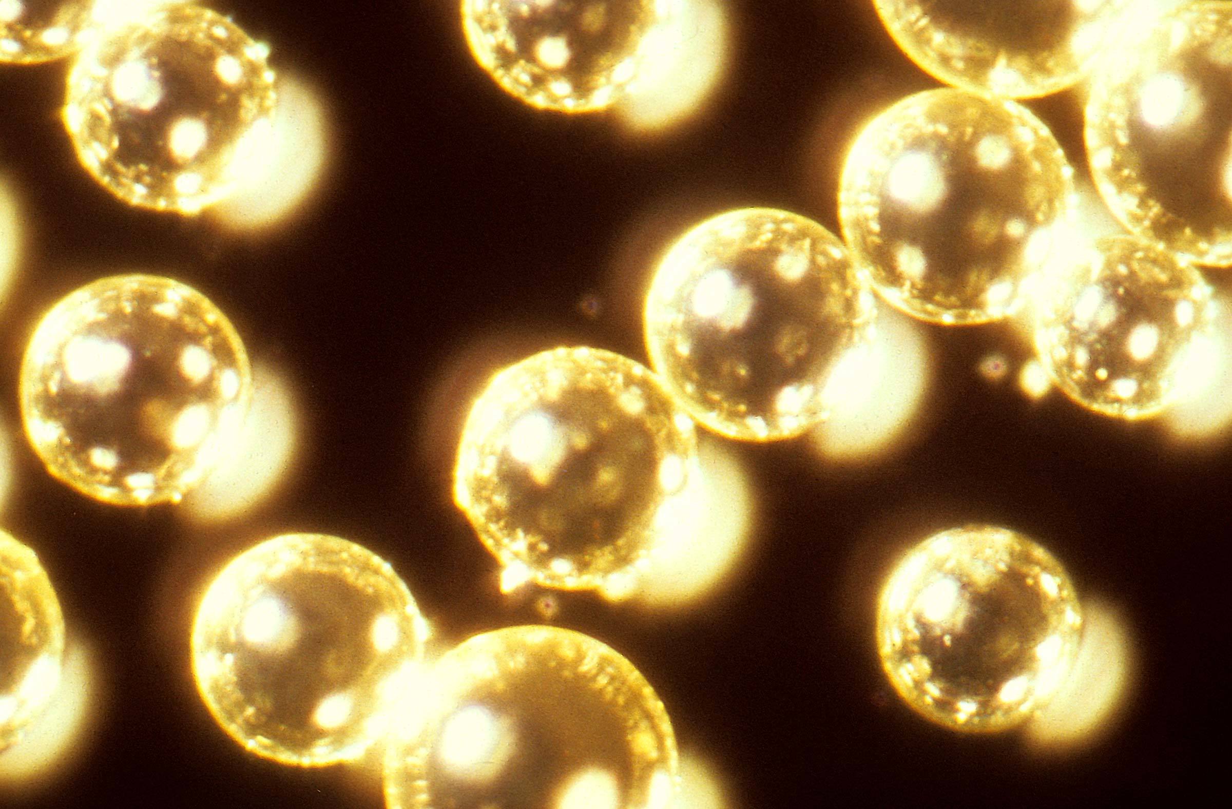 Micro-encapsulated anti-cholesterol drug | Nikon Small World