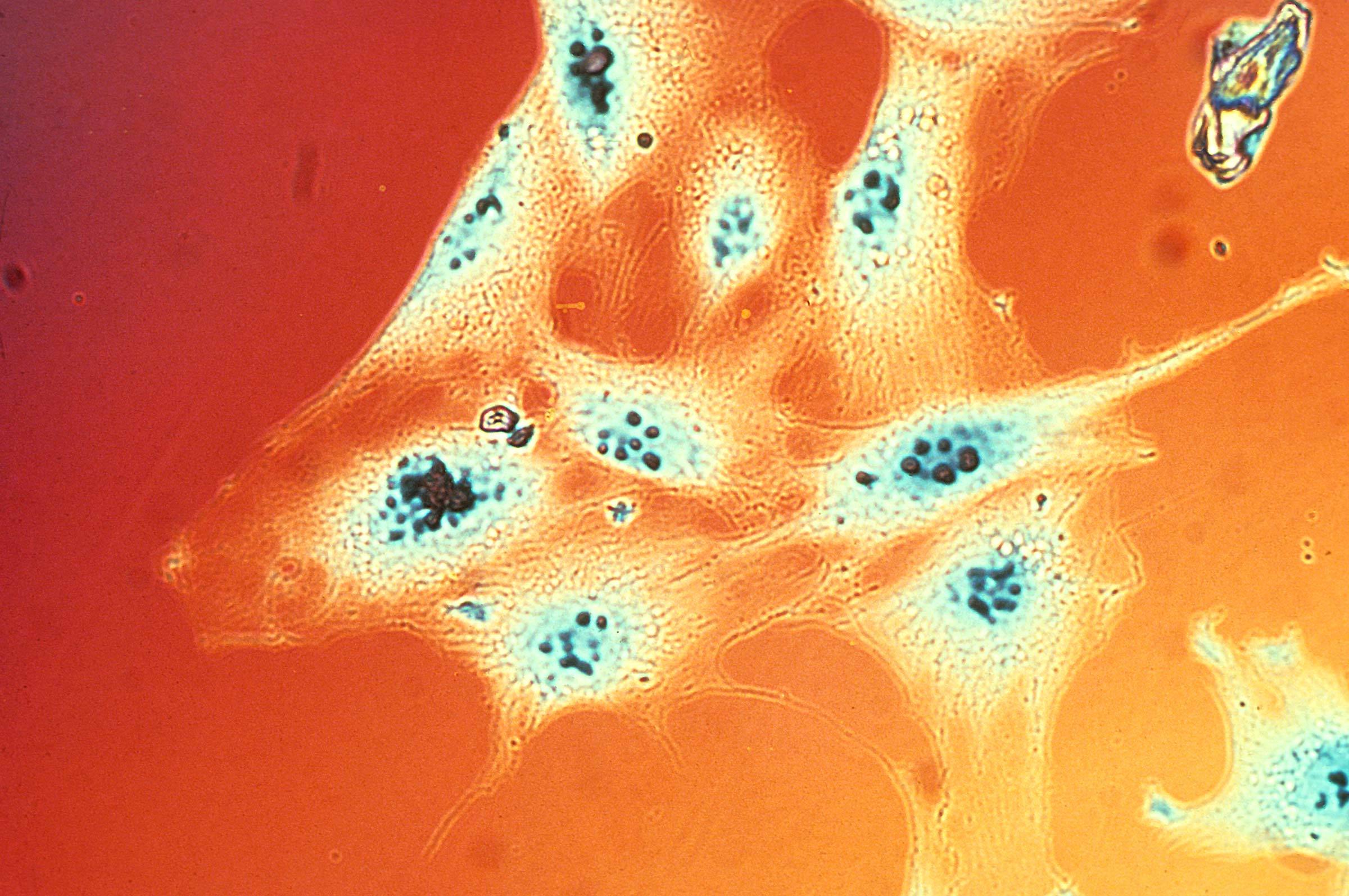 Colony of mouse fibroblasts | Nikon Small World