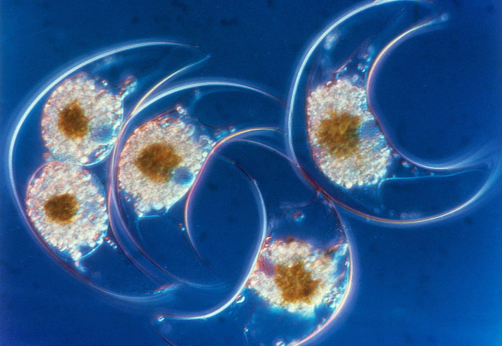 Phytoplankton specimen | Nikon Small World
