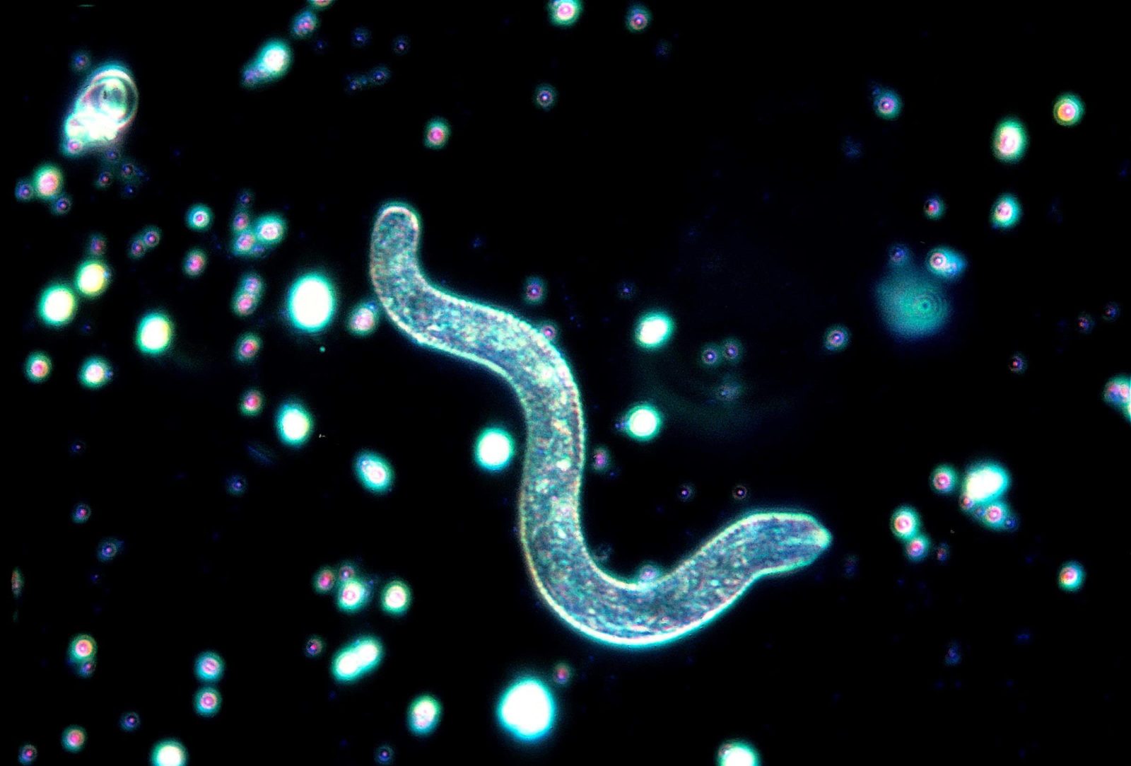 Trichina worm | Nikon Small World