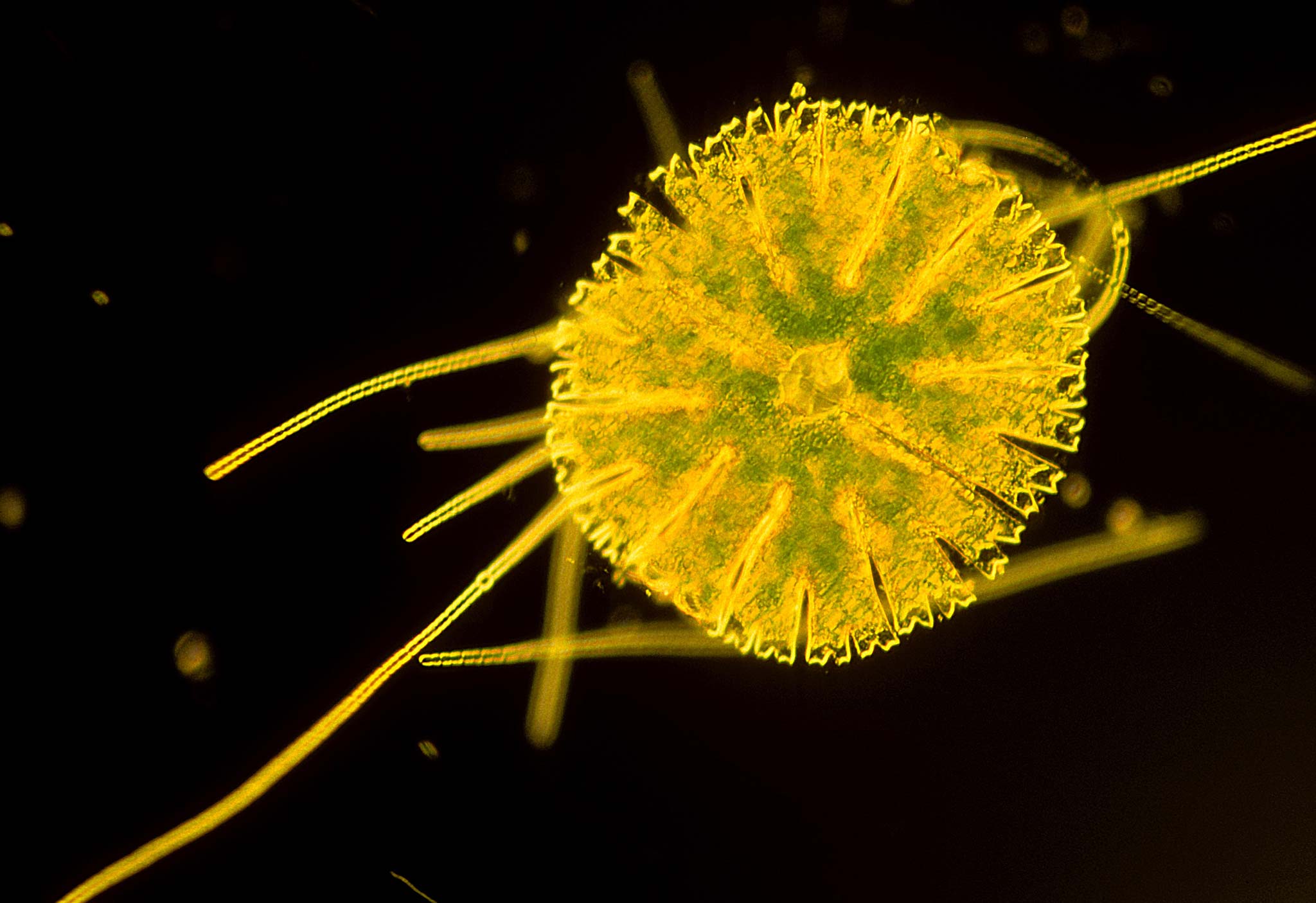 Micrasterias sp. (desmid) with blue green algae strands of Anabena ...