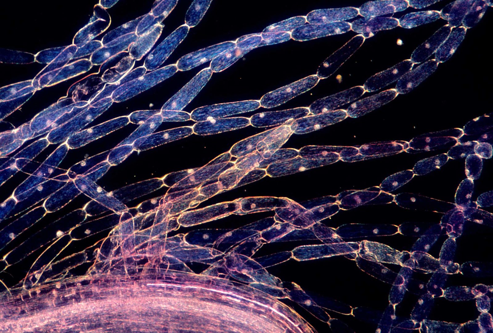 Tradescantia filament trichomes | Nikon Small World