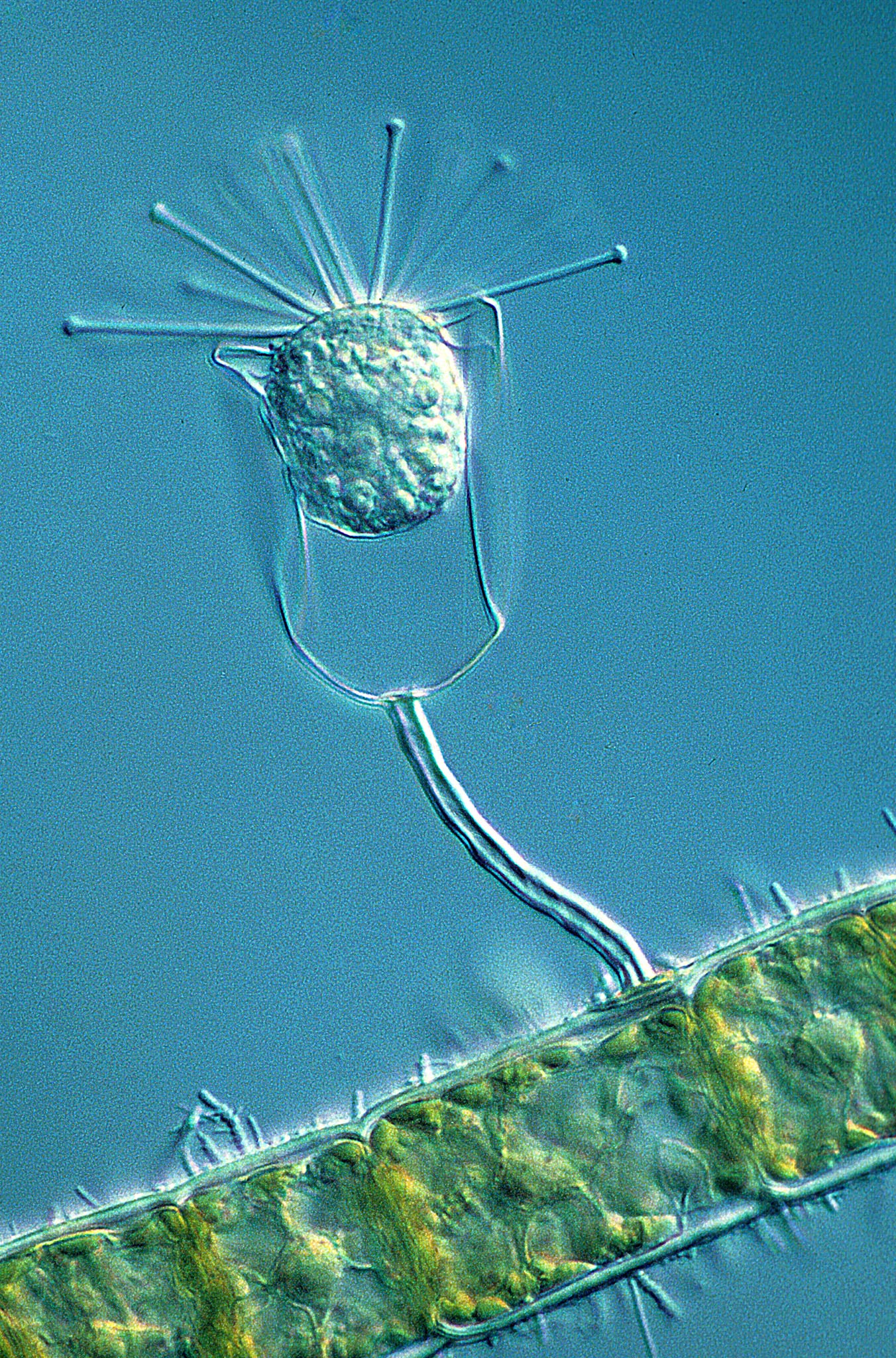 Stalked protozoan attached to a filamentous green algae with bacteria ...