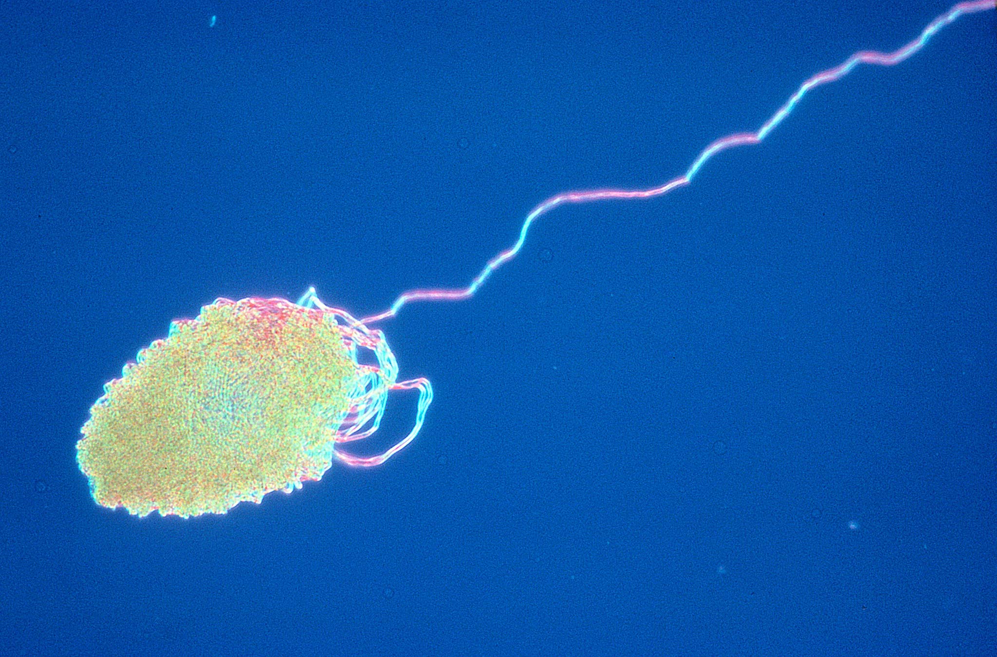 Thread unwinding from thread cell isolated from the slime gland of a ...