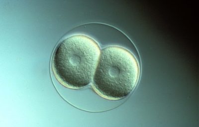 Two cell state with nuclei apparent | Nikon Small World