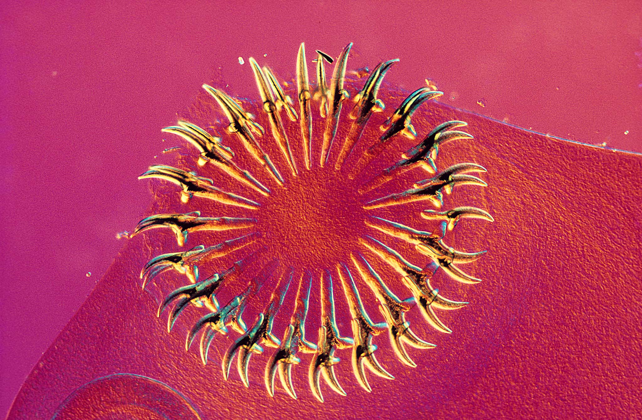 Scolex (head) of a tapeworm (Taenia sp) showing a circular ring of ...