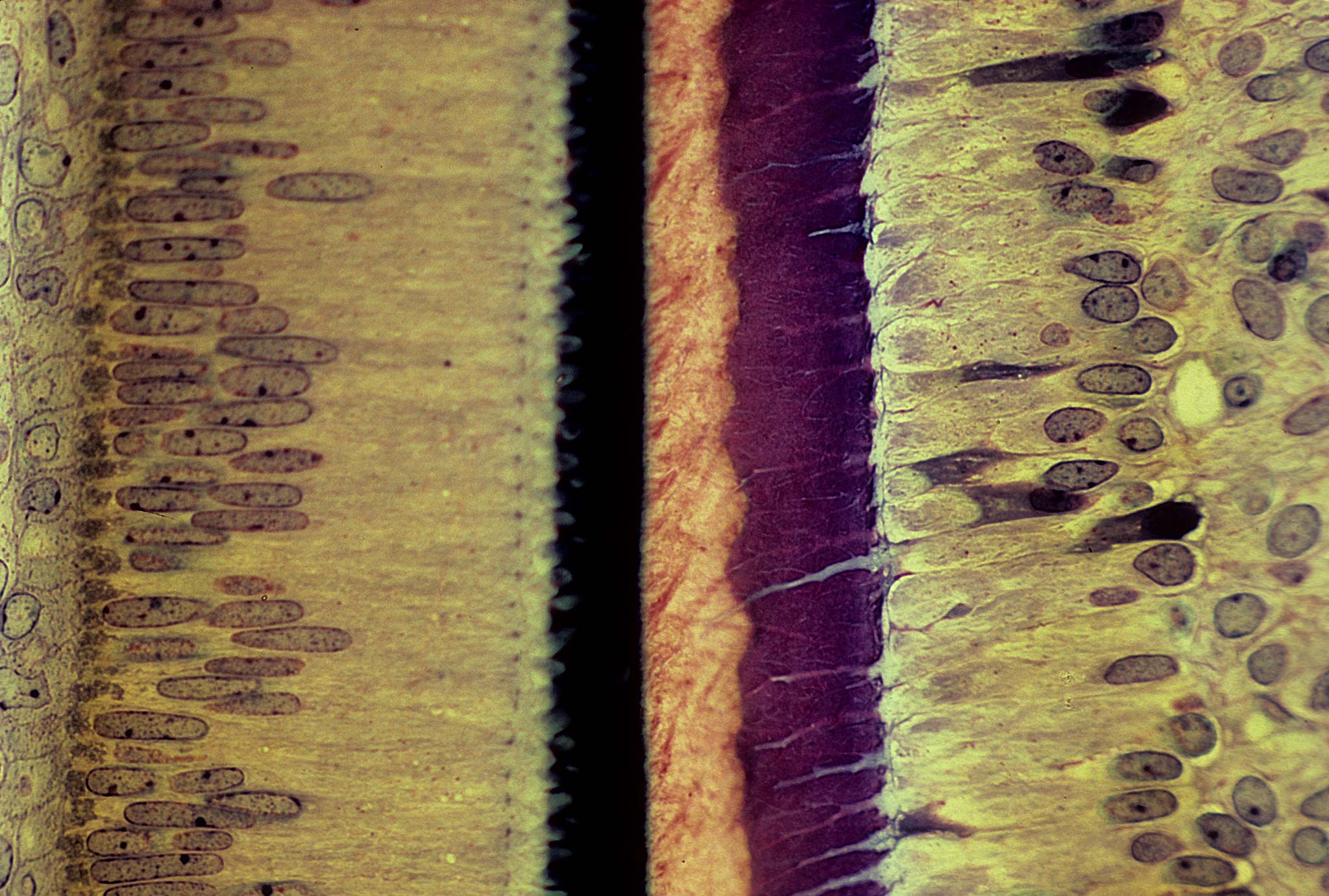 Basal end of growing rat incisor. Stained ground section of plastic ...
