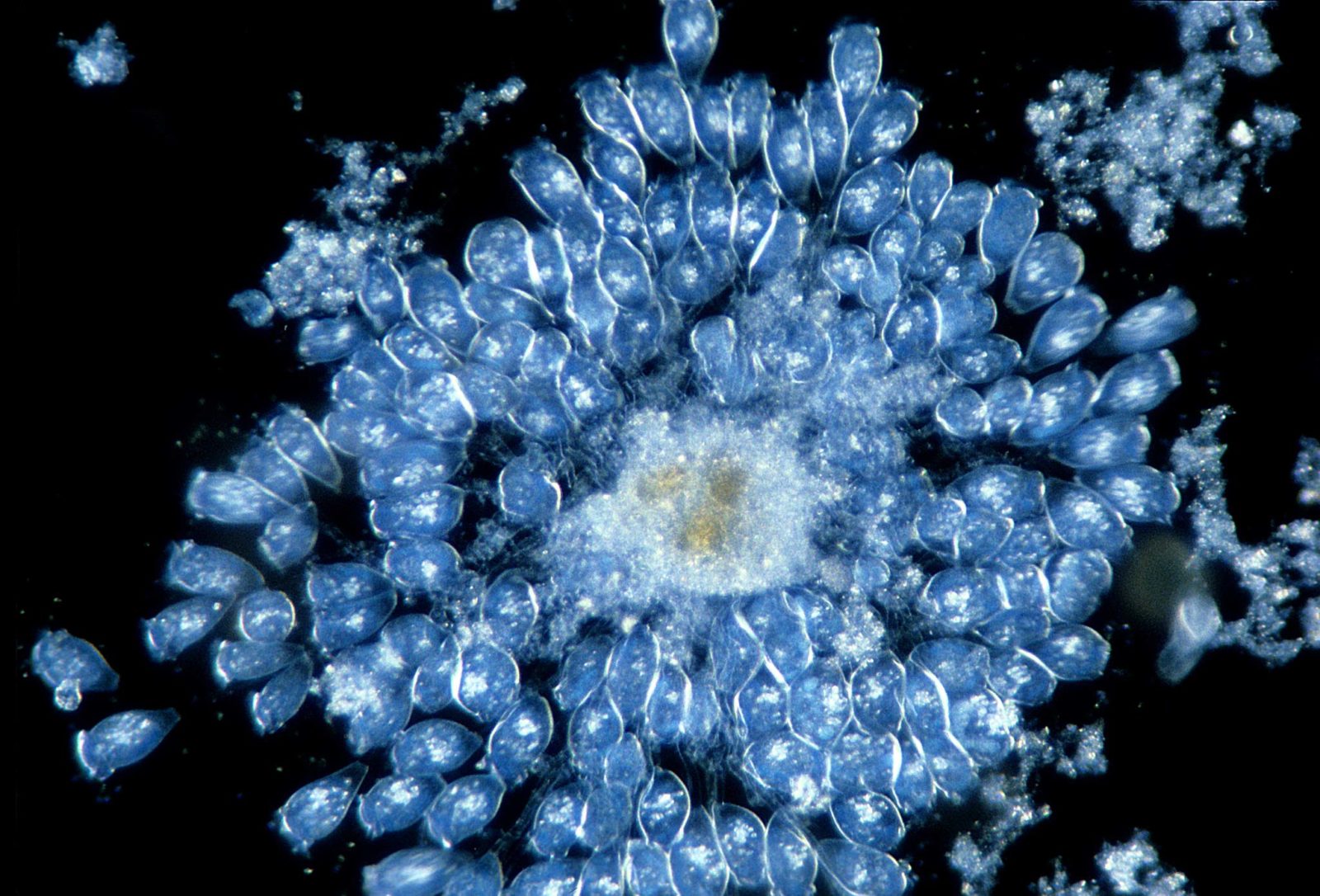 Live, colonial ciliate (Vorticella protozoa) of abnormal size | Nikon ...