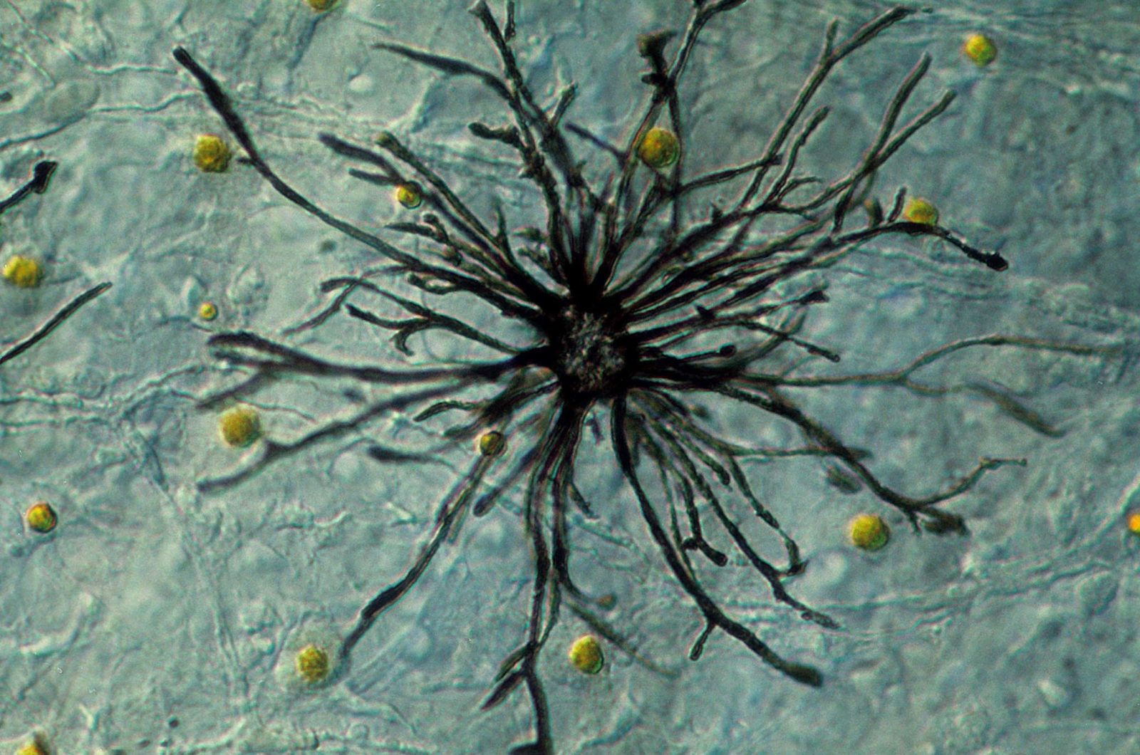 A melanophore surrounded by smaller orange xanthophores in the dermis ...