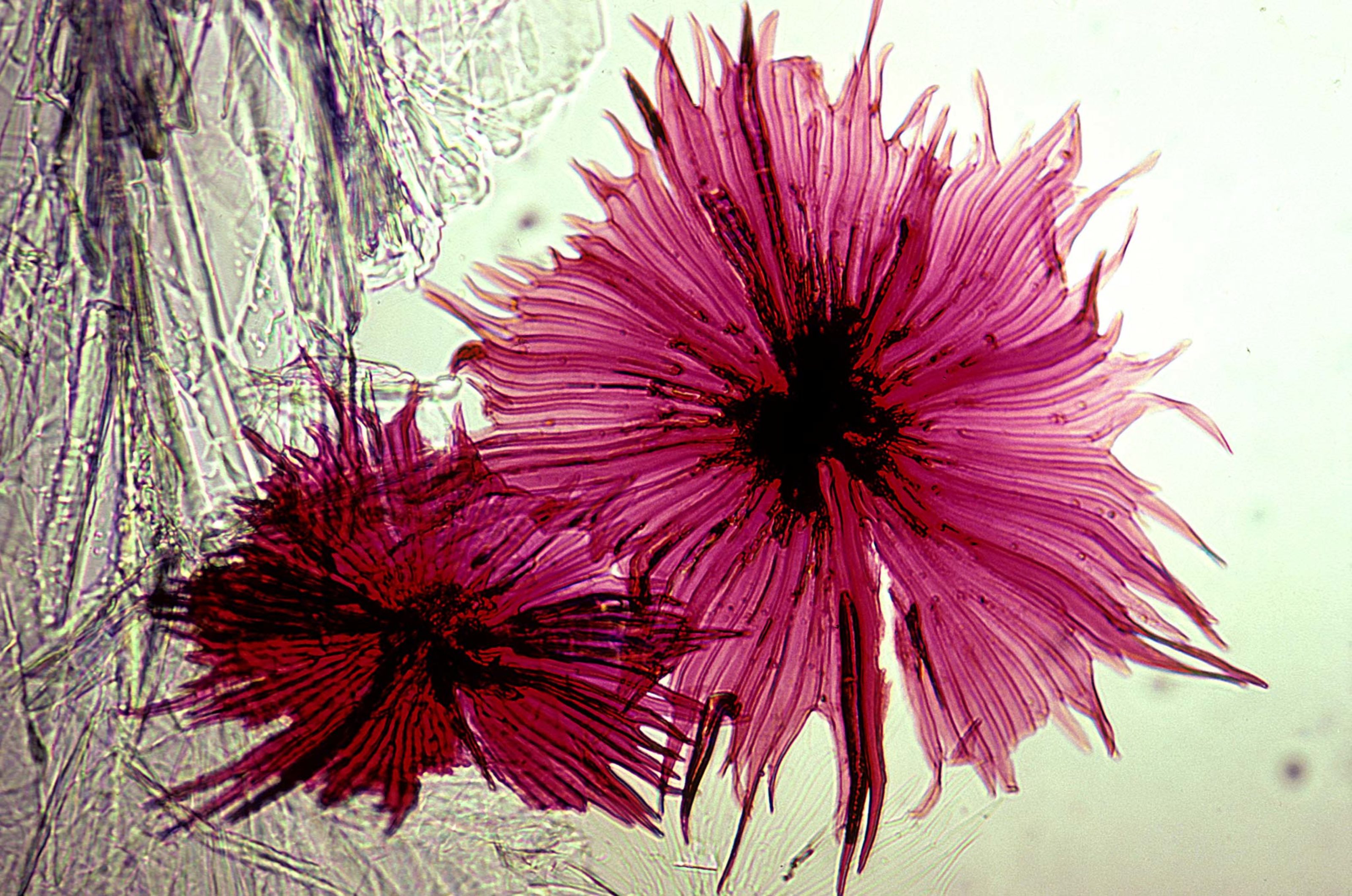 Silverberry scaly hair whole mount | Nikon Small World