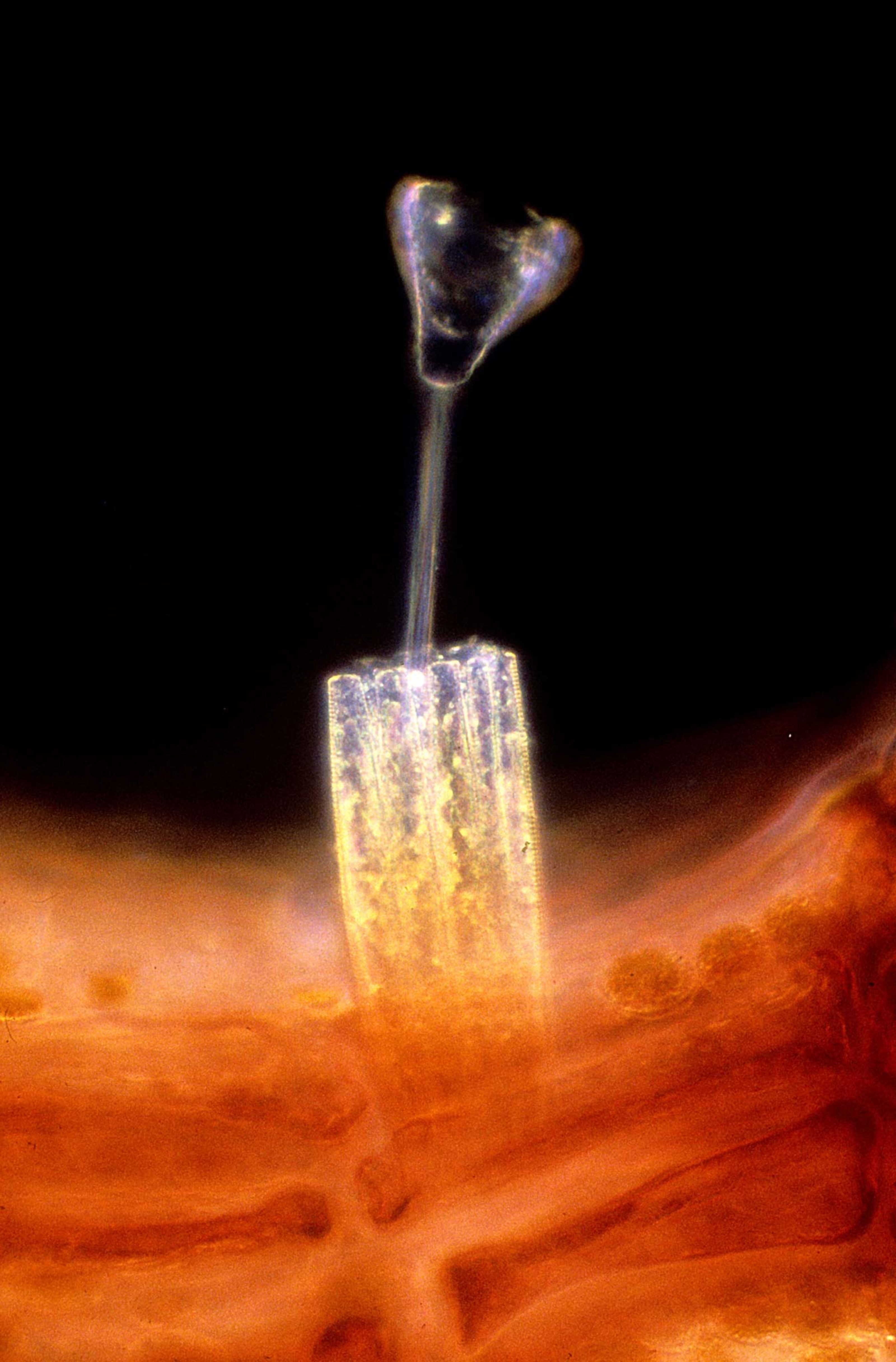 Suctorian attached to stalk of red algae, encircled by ring of diatoms ...