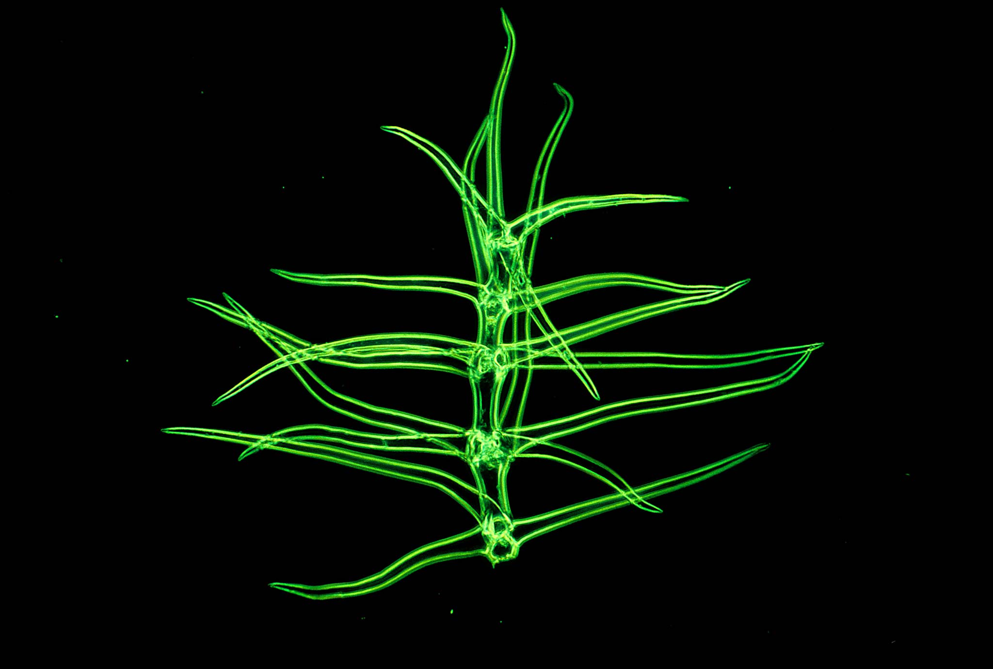 Sporangia of climbing fern, (sp. Lygodium) stained with safranin ...