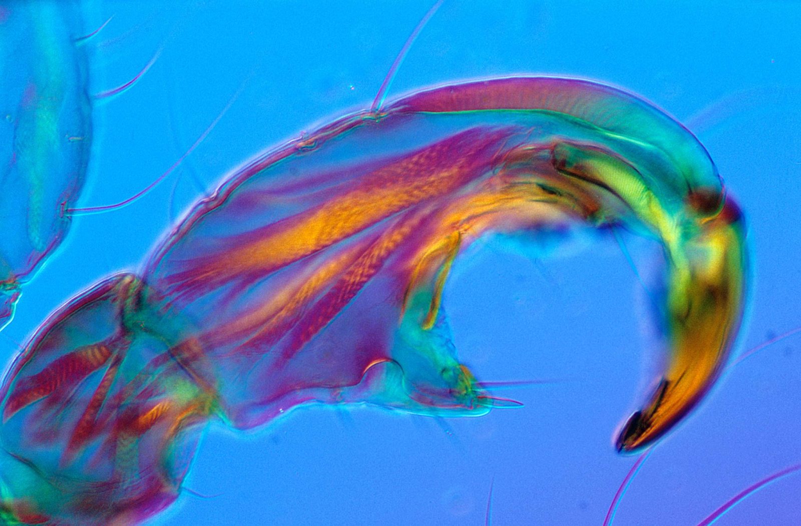 Claw of louse (sp. Phthirus pubis) showing muscle attachment to ...