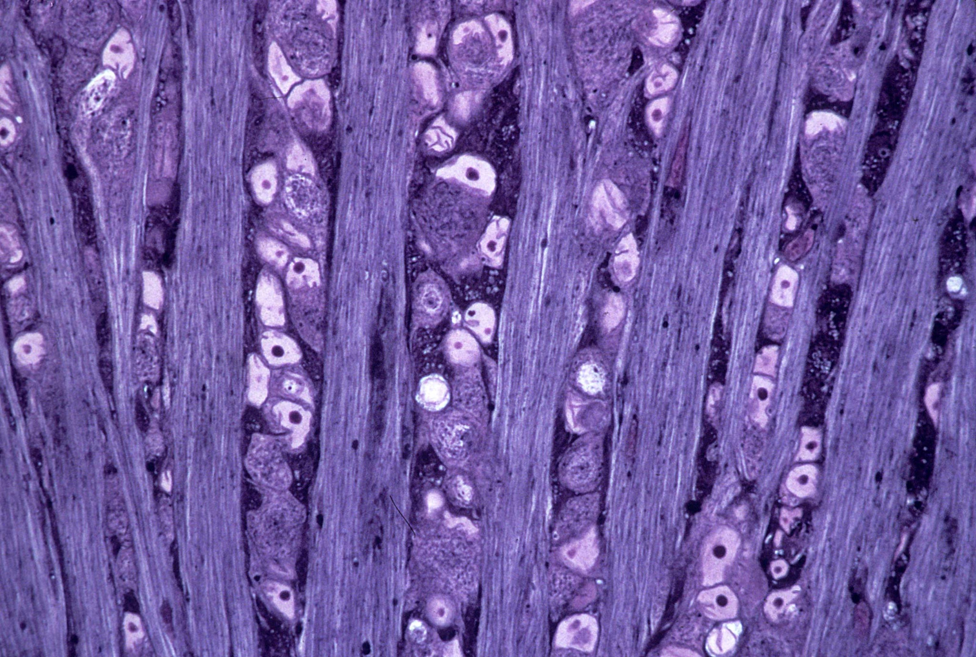 Retinal ganglion cells and axons in the retina of a frog | Nikon Small ...