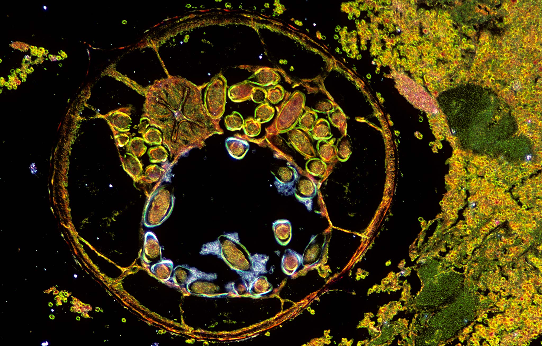Cross section of pinworm (sp. Euterobius vermicularis) in lumen of ...