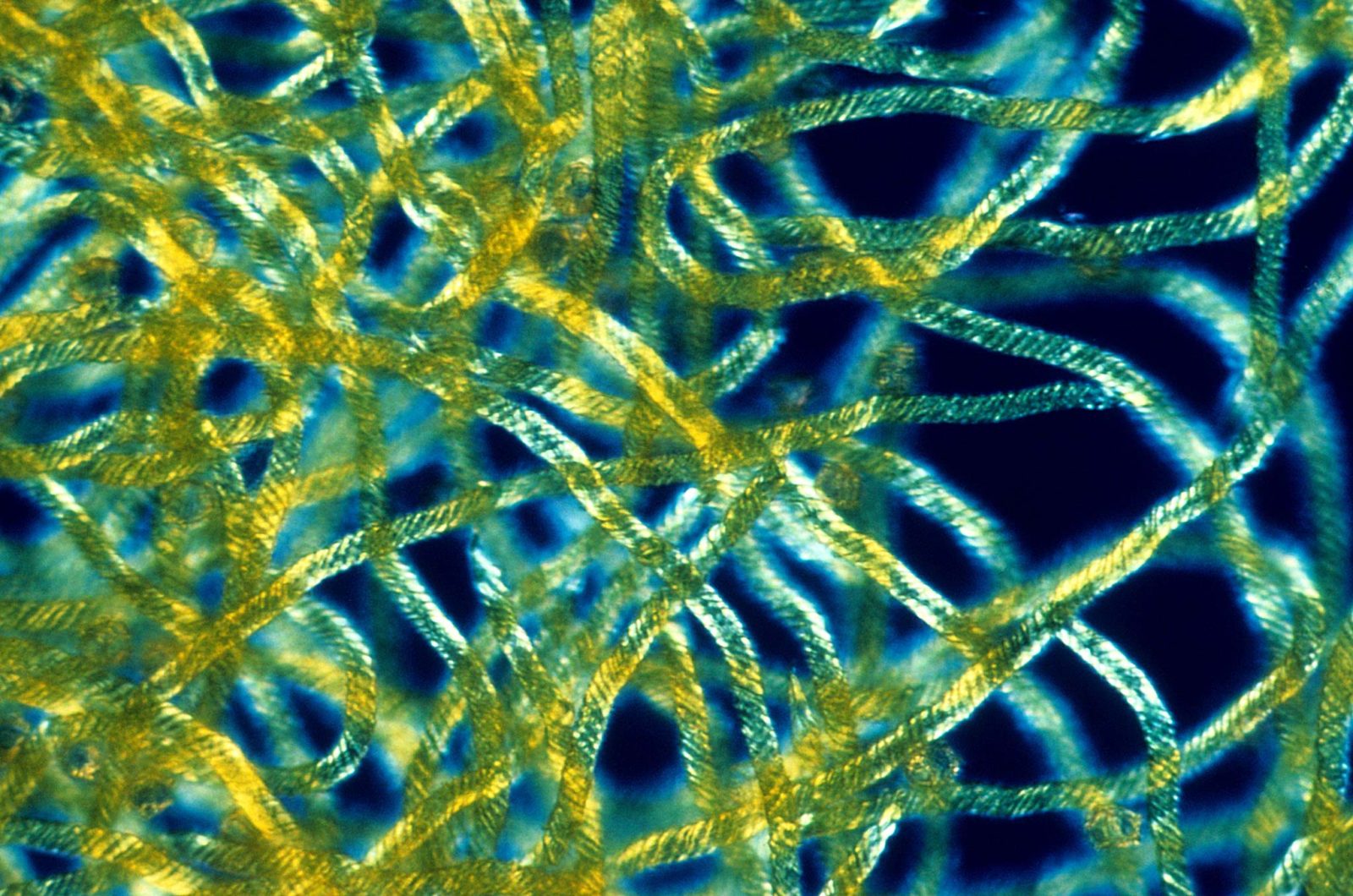 Myxomycete capillitium | Nikon Small World