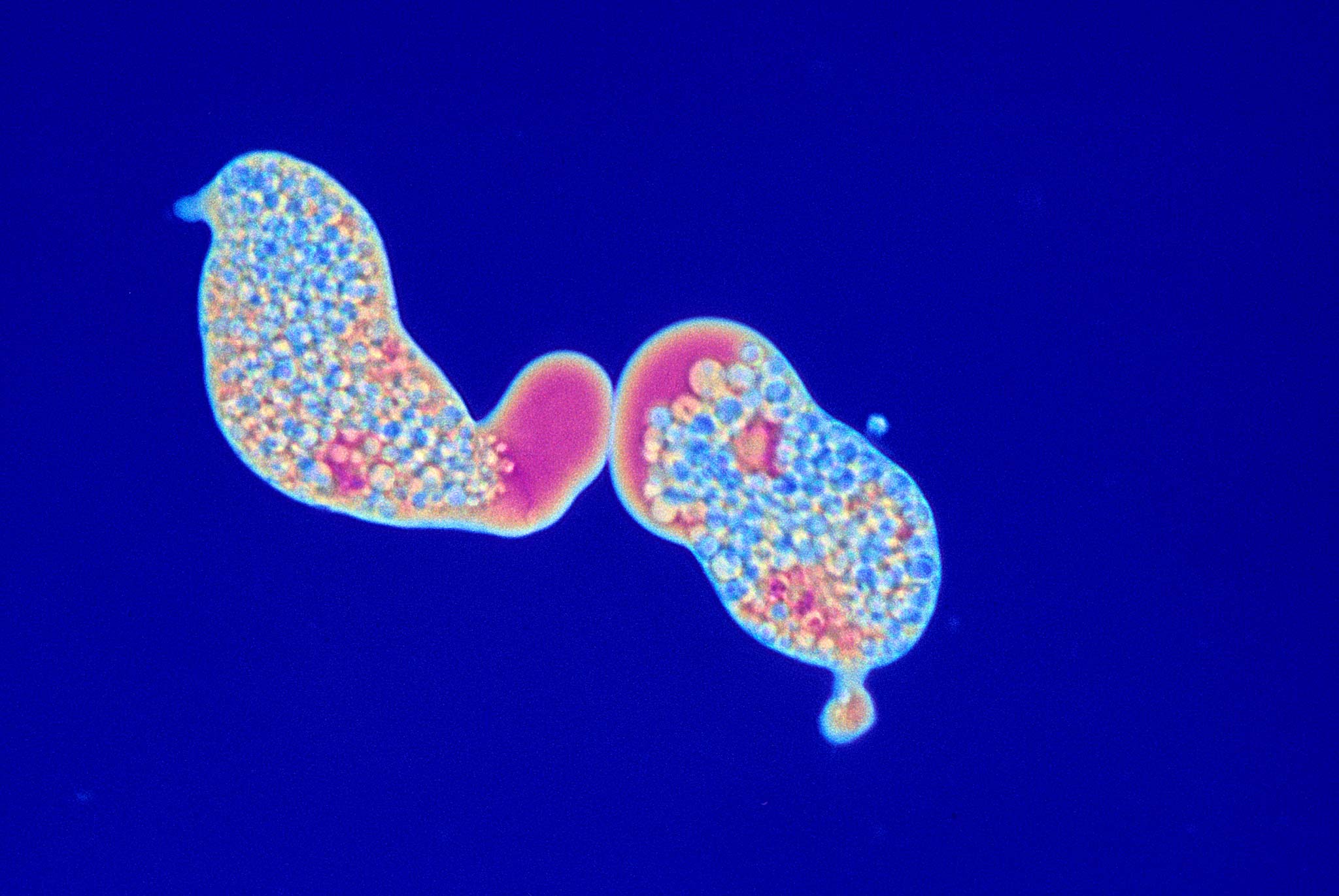 Entamoeba histolytica in axenic culture | Nikon Small World