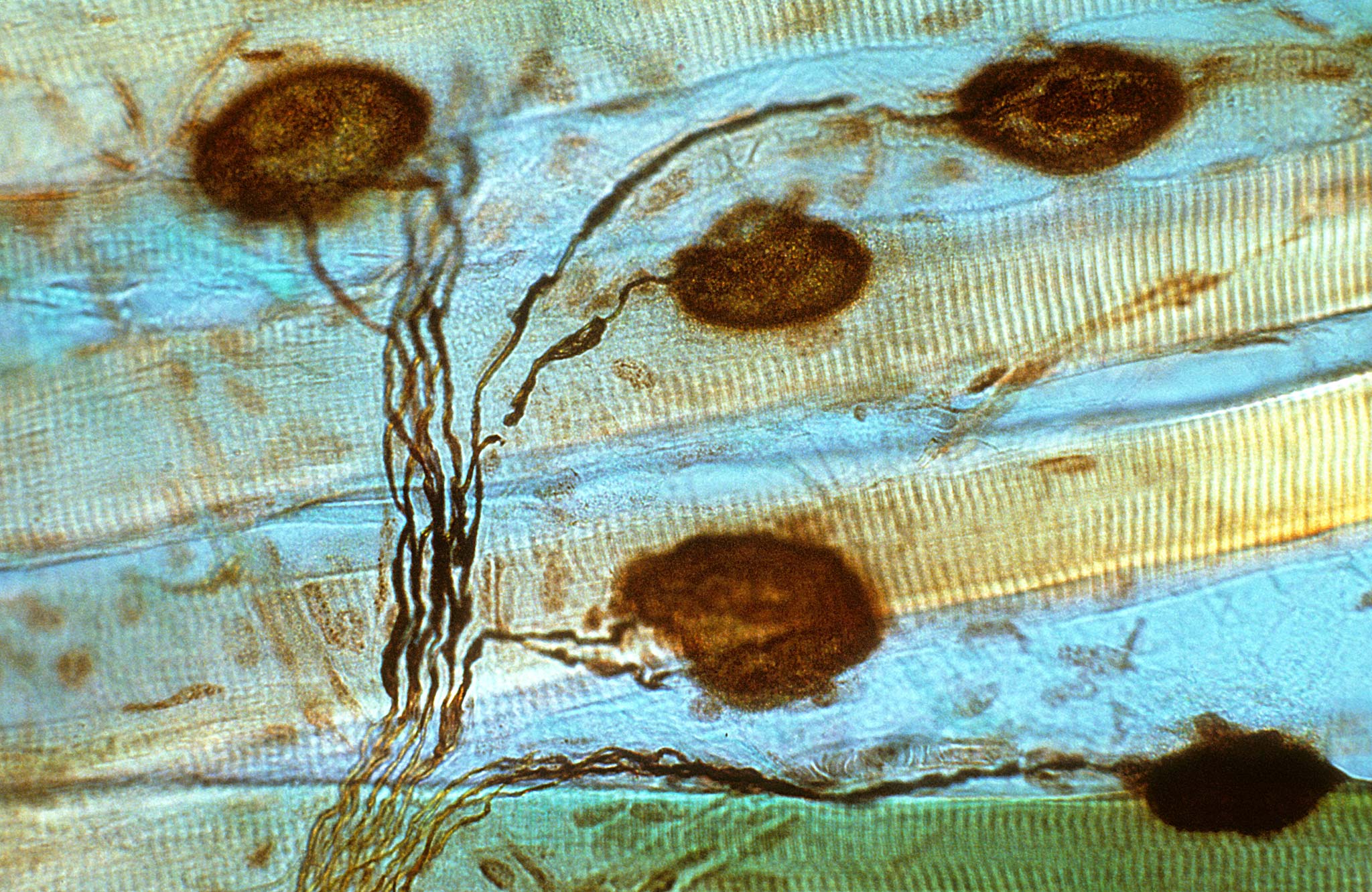 Nerve fibers in compressed frozen muscle tissue of white rat | Nikon ...