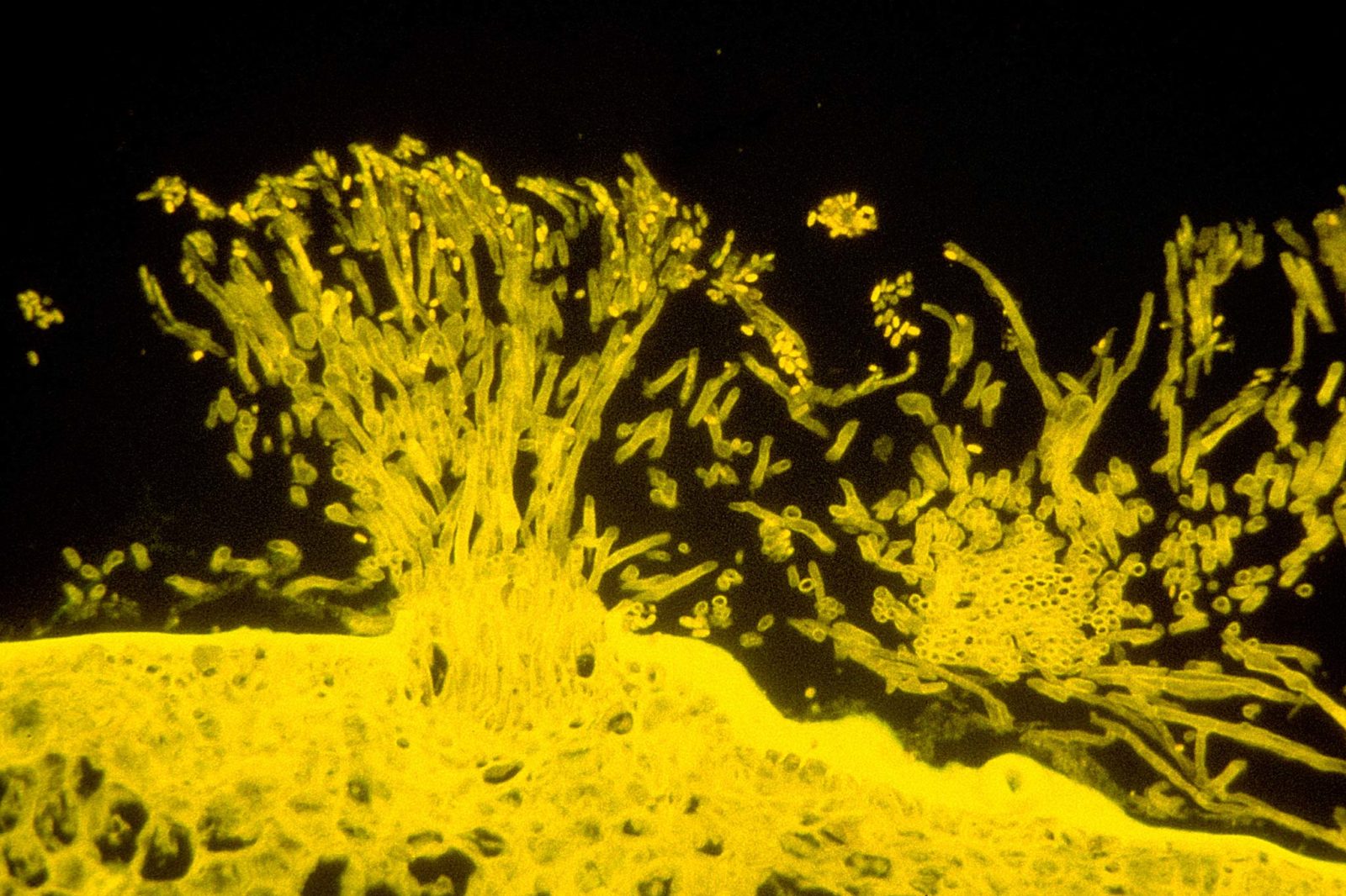 Cross section of orange peel with mould exploding through skin | Nikon ...