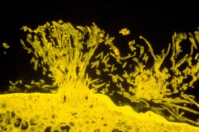 Cross section of orange peel with mould exploding through skin | Nikon ...