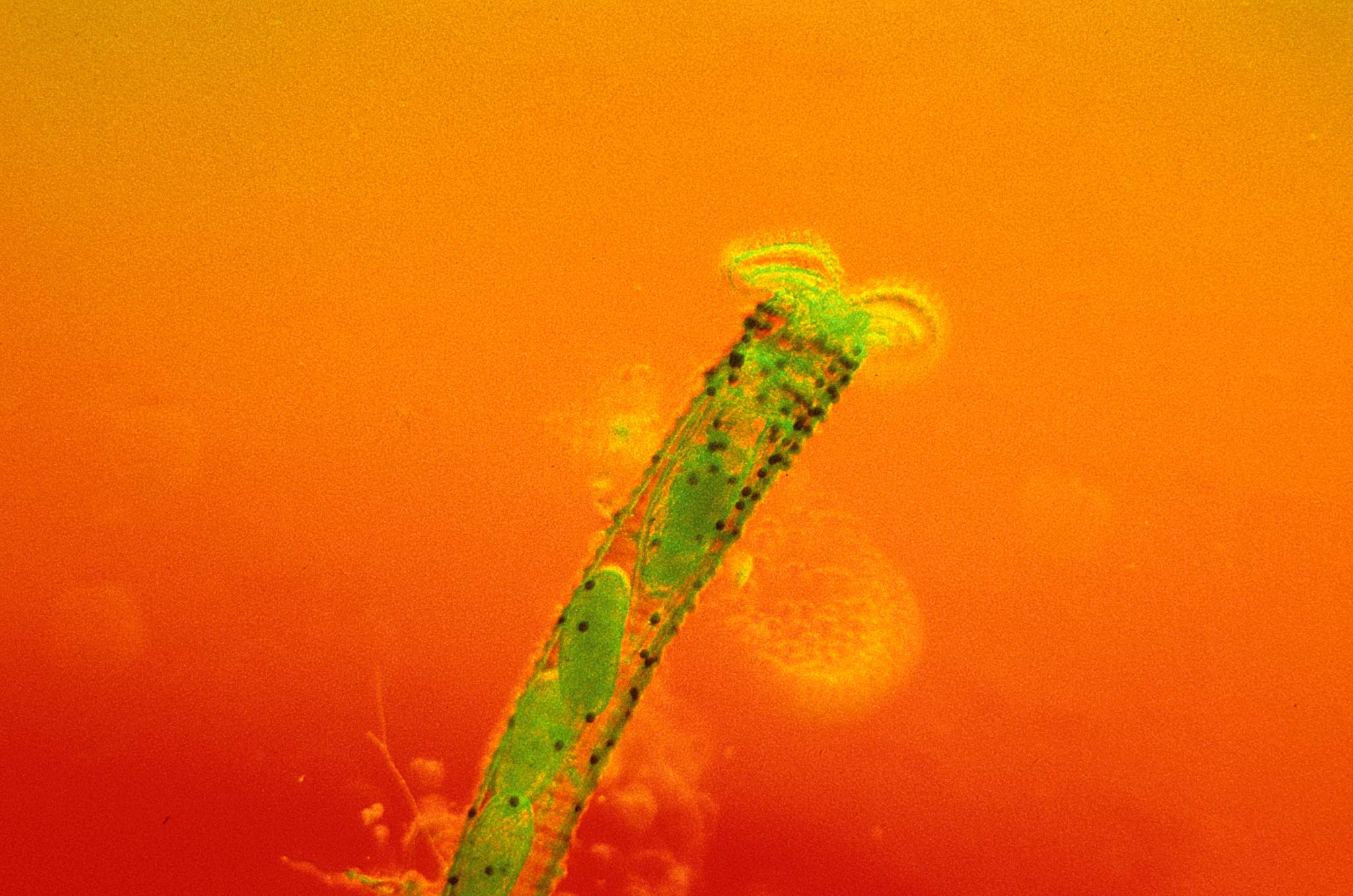 Limnias melicerta (a rotifer) | Nikon Small World