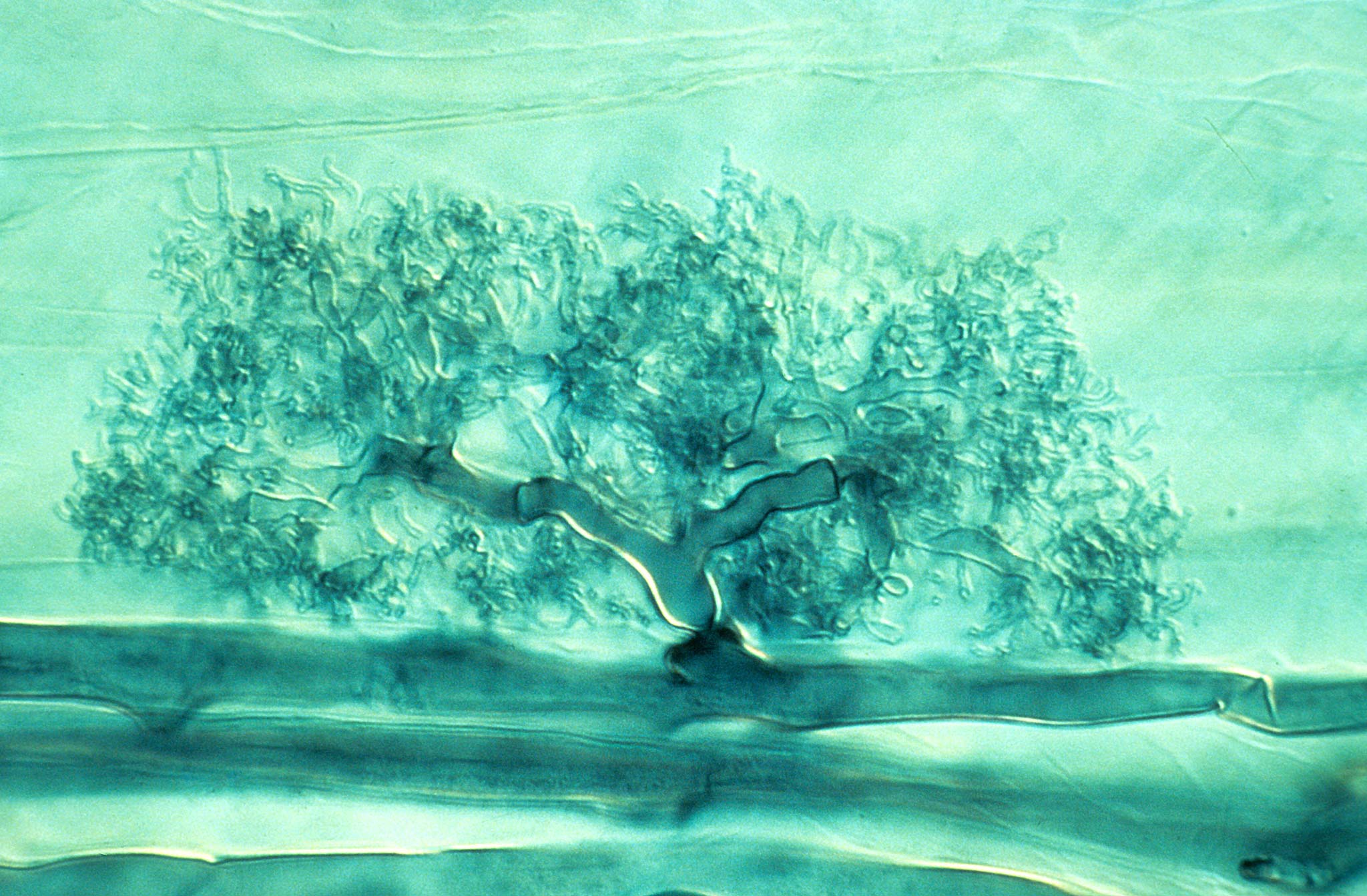 Arbuscle of a mycorrhizal fungus within a root cell | Nikon Small World