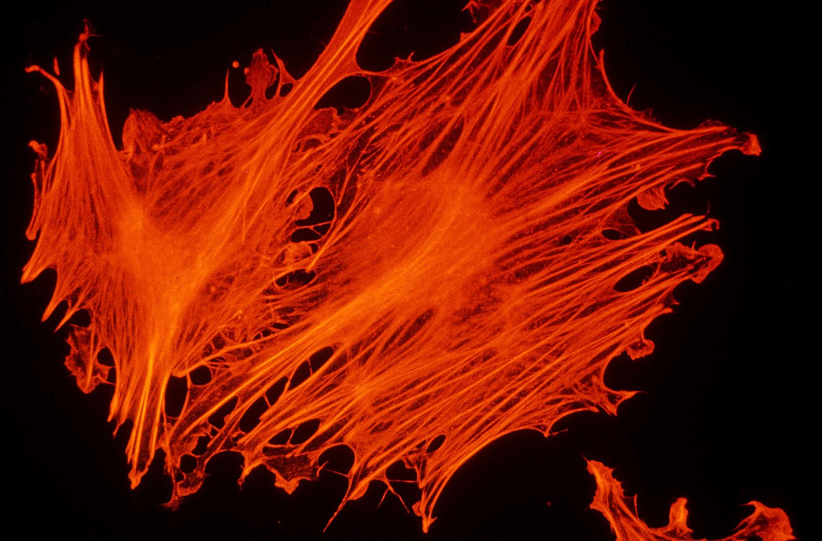 Stress fibers in smooth muscle cells | Nikon Small World
