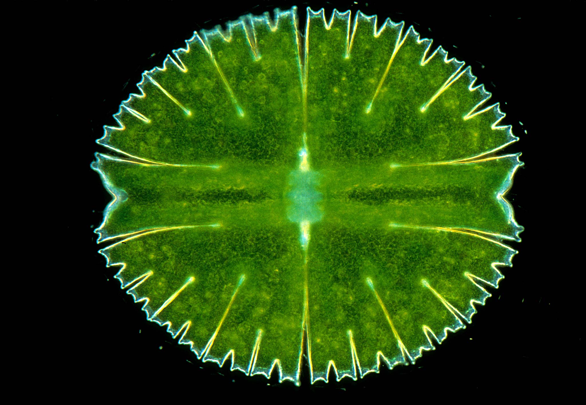 Live desmid Micrasterias rotata | Nikon Small World