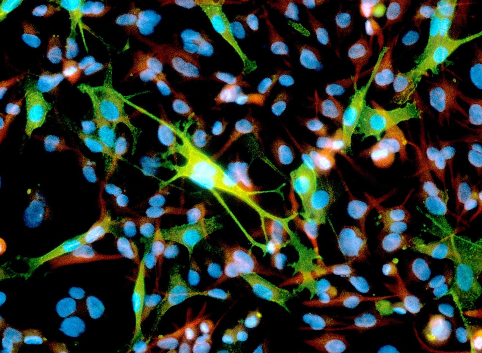 Triple exposure of melanoma and astrocytoma cell culture | Nikon Small ...