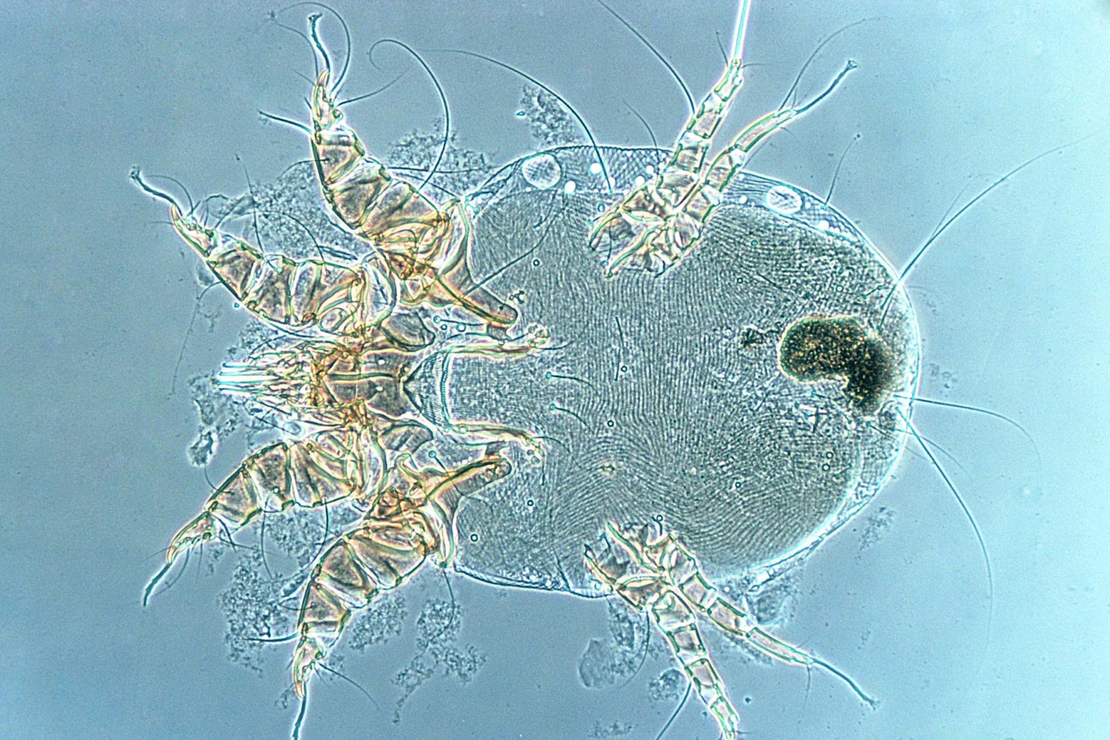 Psoroptes bovis | Nikon Small World
