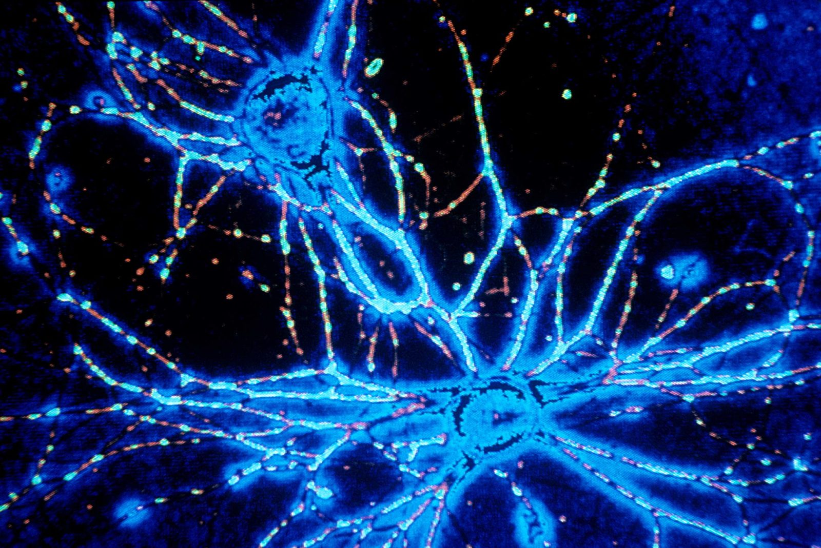 Helisoma trivolis (pond snail) neurons | Nikon Small World