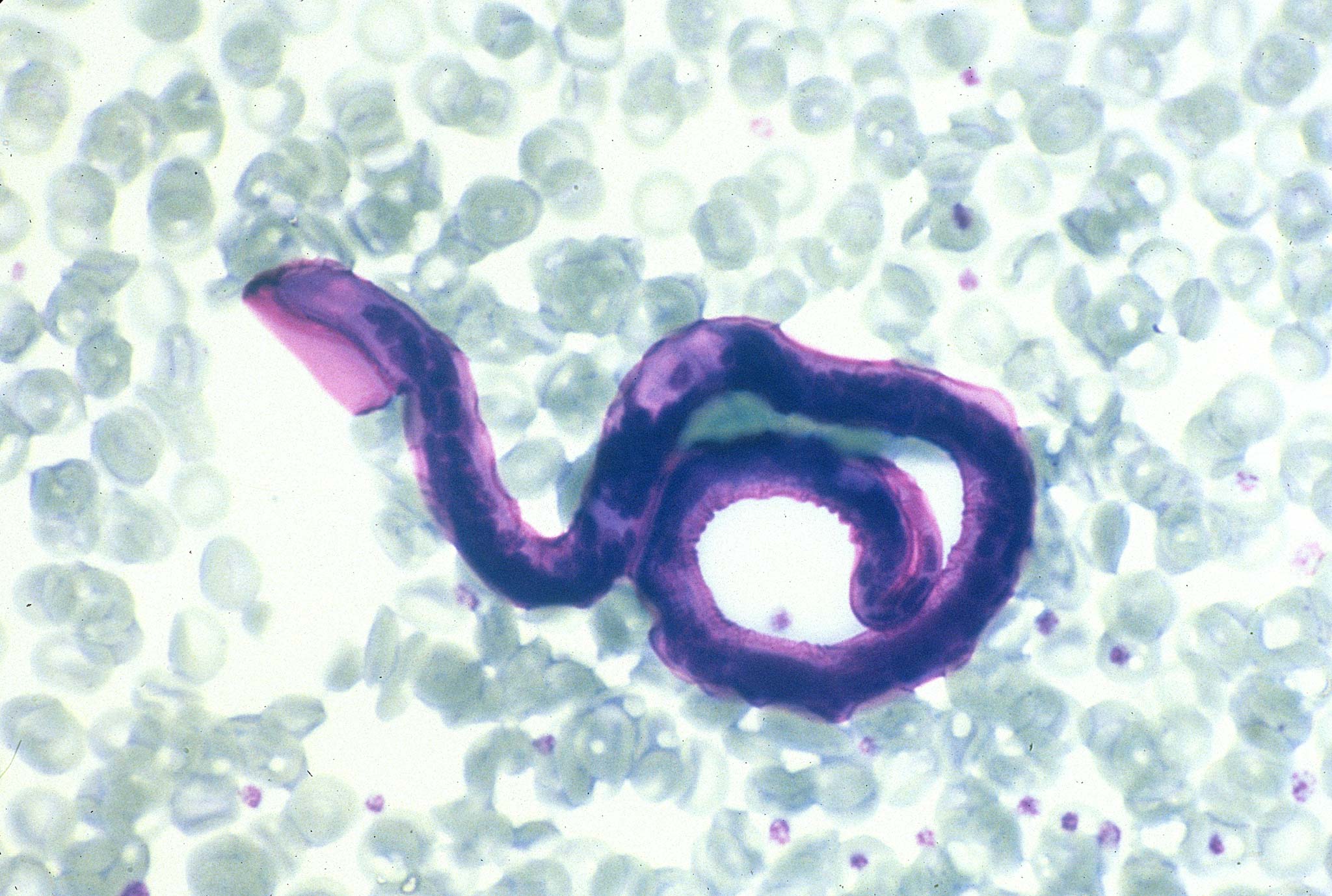 Microfilaria (parasitic nematode) in human blood smear | Nikon Small World