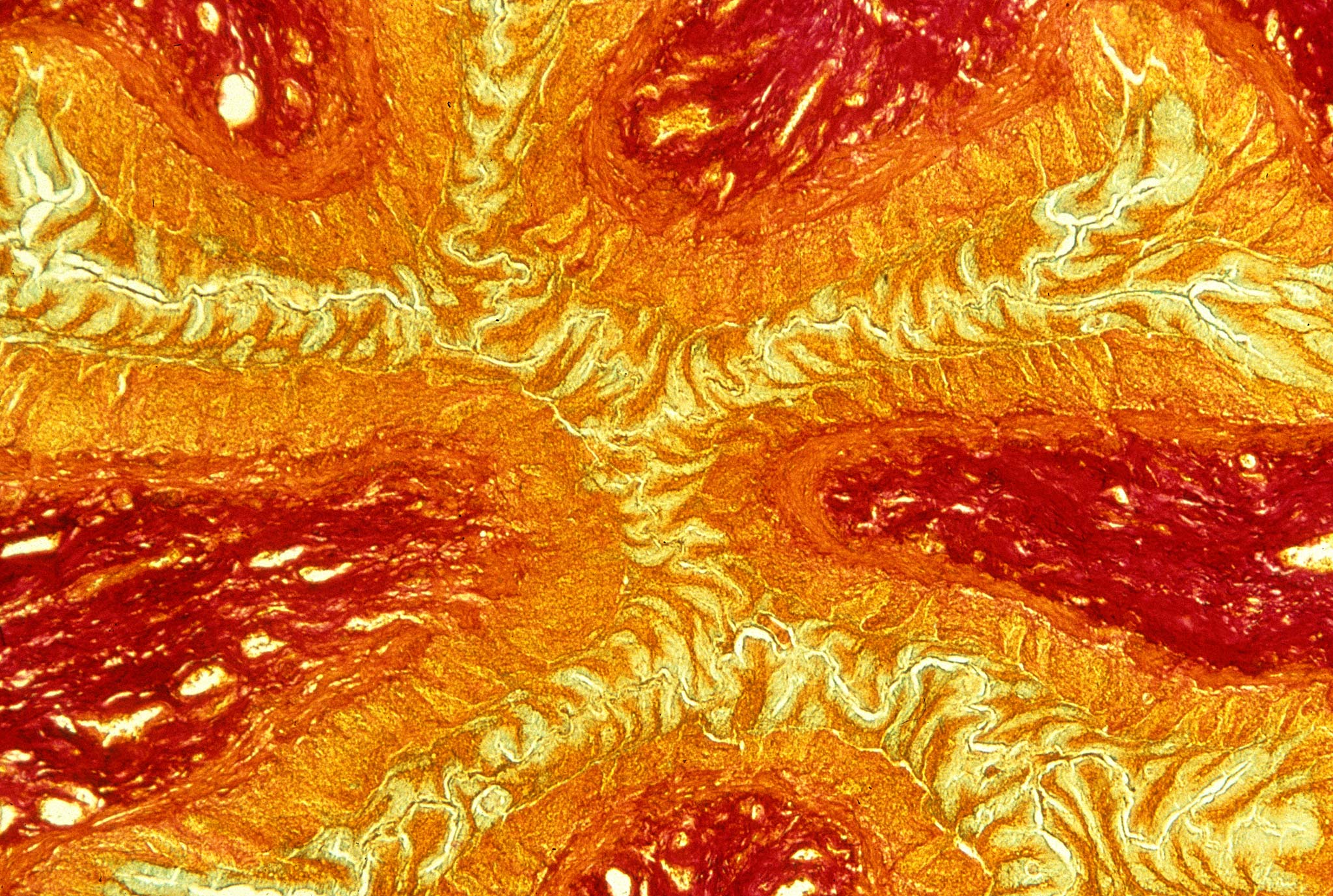 Intestinal lining of a soft shell turtle | Nikon Small World