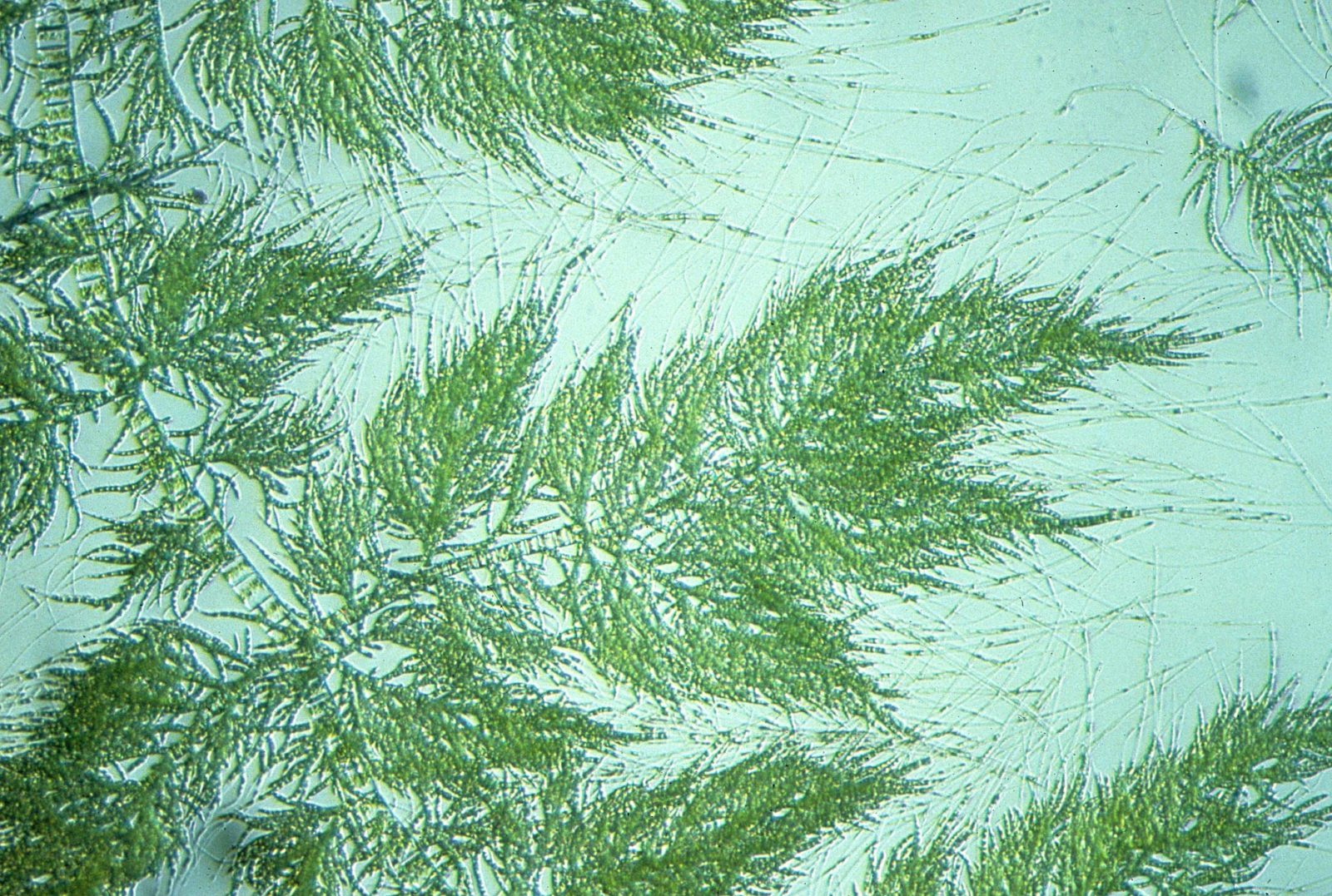 Draparnaldia glomerata algae | Nikon Small World