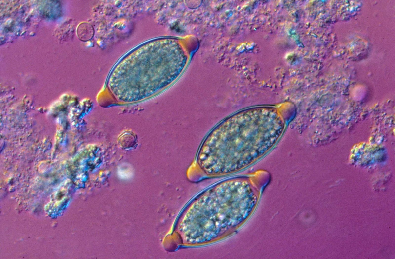 Unembryonated eggs of a swine whipworm (Trichuris suis) | Nikon Small World