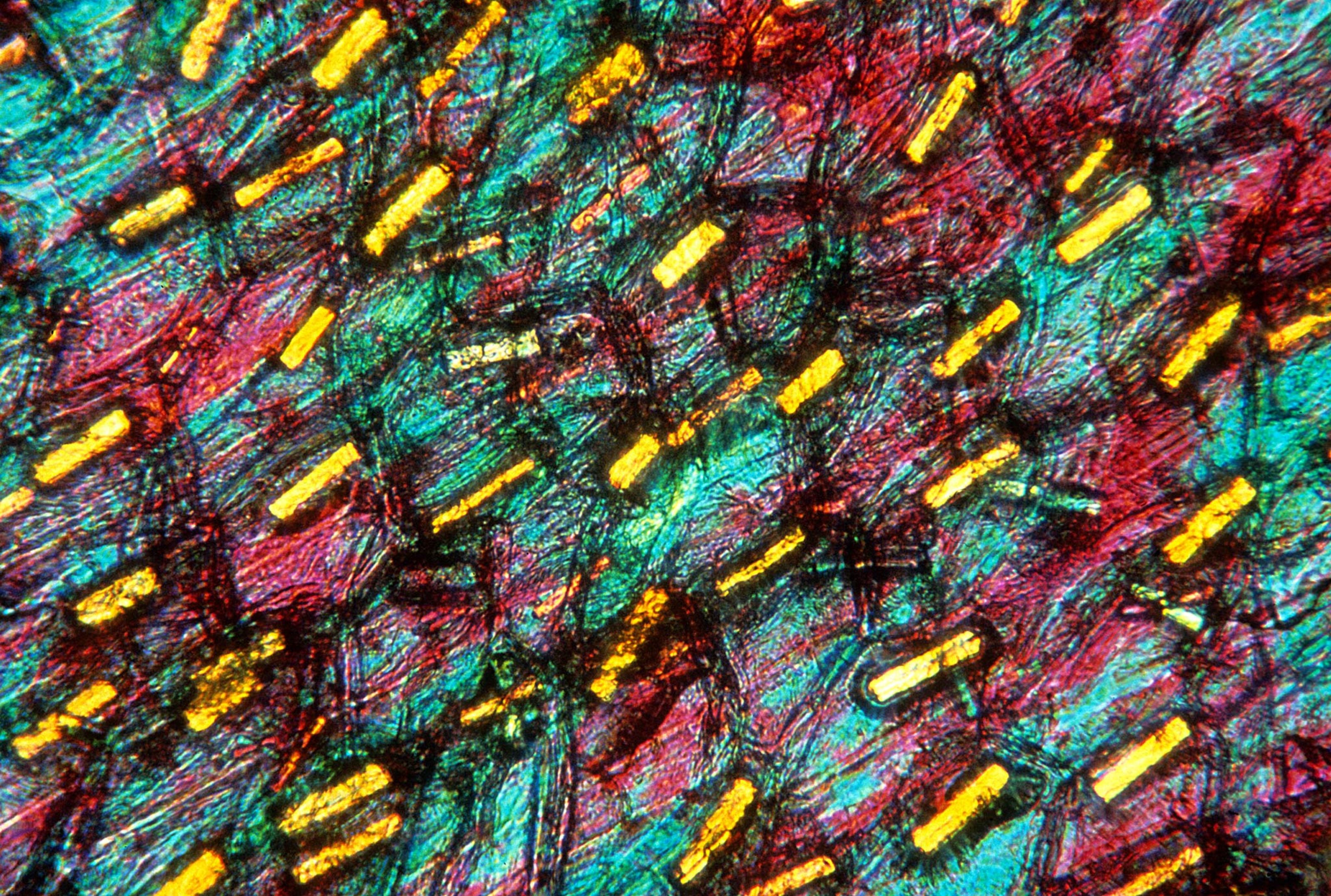 Crystallized oxalic acid in the dry leaves of onion | Nikon Small World
