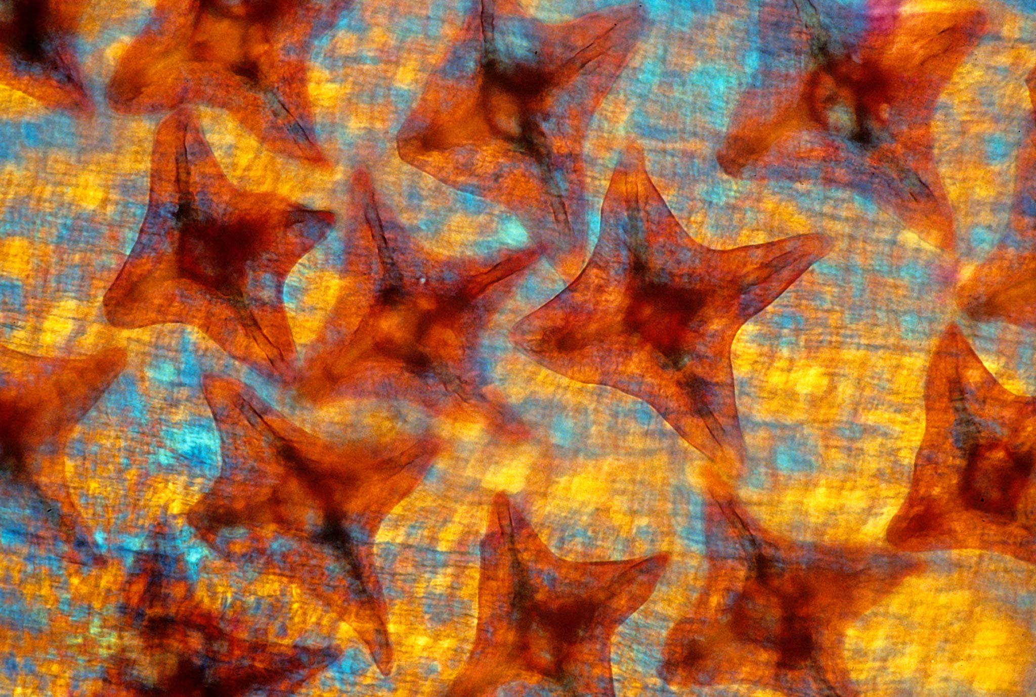 Dogfish placoid scale | Nikon Small World