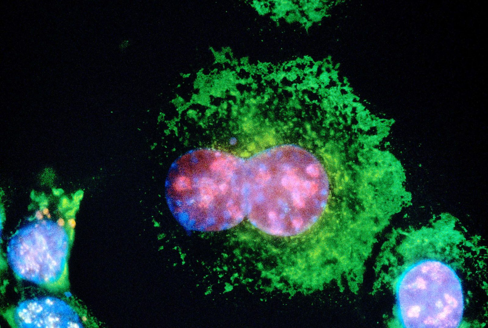 Mouse 3T3 Cells | Nikon Small World