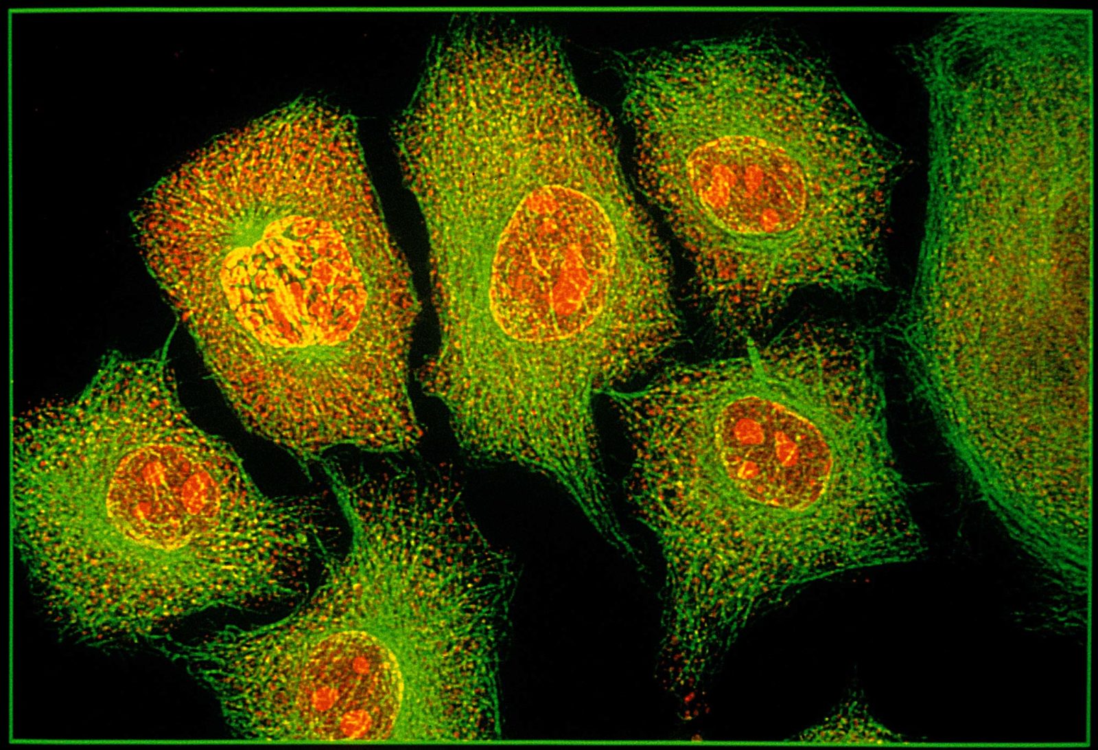 HeLa tissue culture cells | Nikon Small World