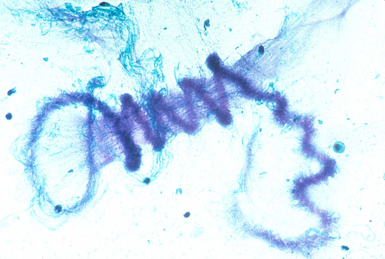 Curschmann’s Spiral in sputum specimen | Nikon Small World