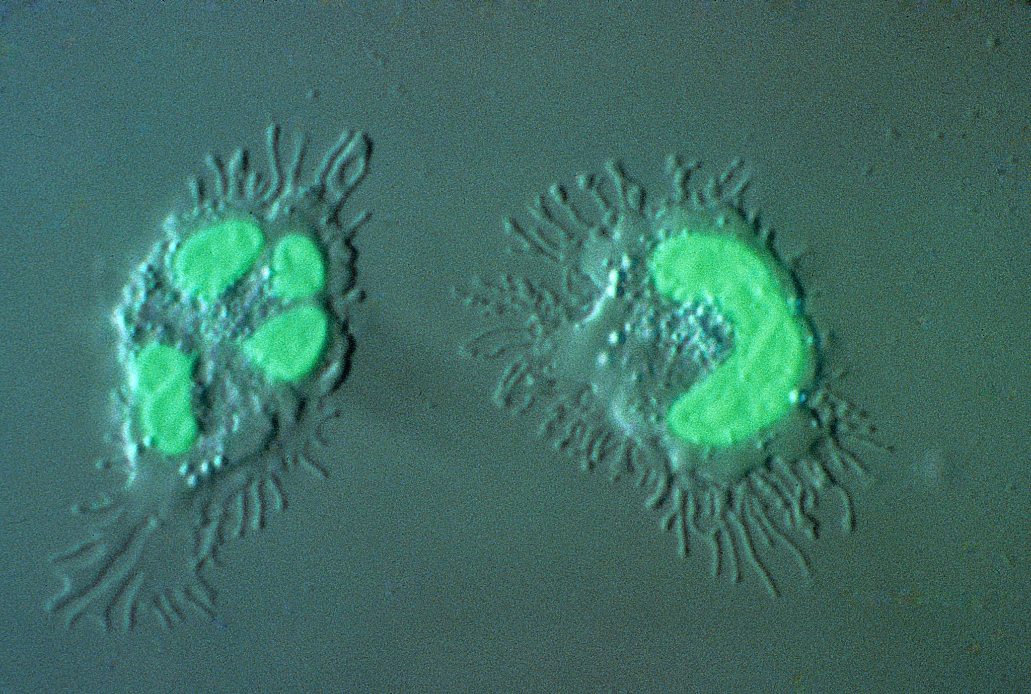 Freshly isolated human neutrophil | Nikon Small World