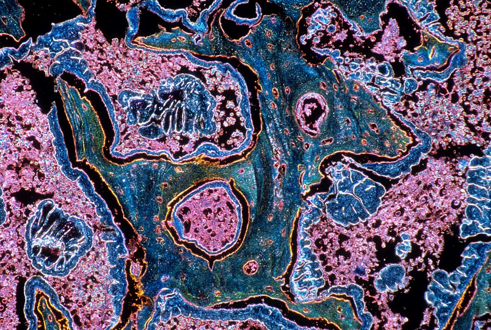 Thin section through an alkali-gabbro (Essexite) showing large sector ...