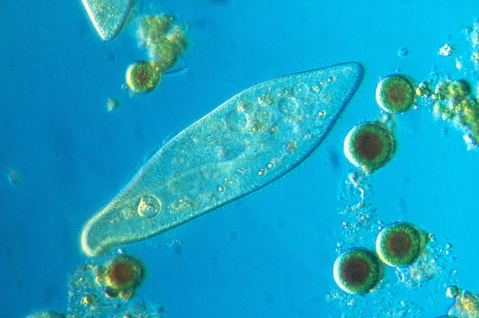 Live paramecium feeding on Haematococcus algae | Nikon Small World
