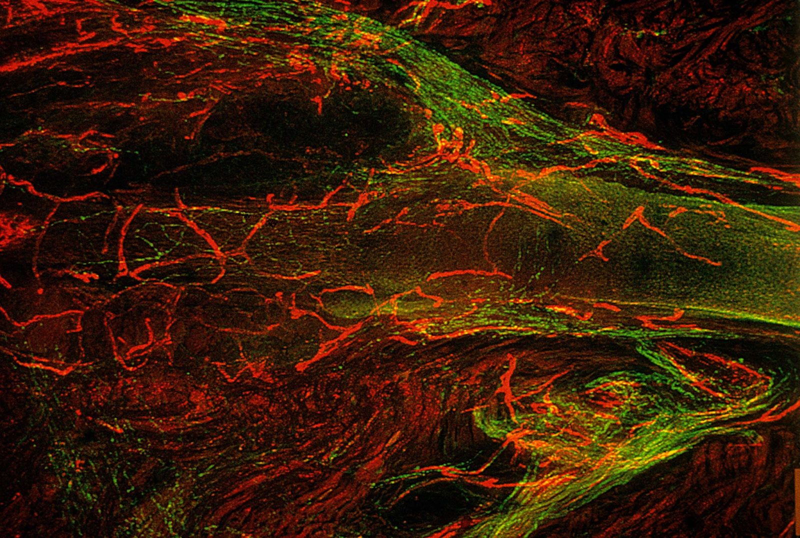 Nerves and blood vessels of a hair follicle | Nikon Small World