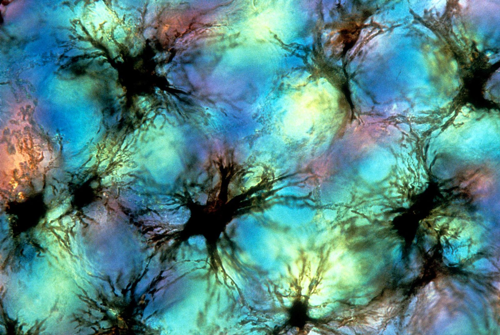 Melanocytes in frog skin | Nikon Small World