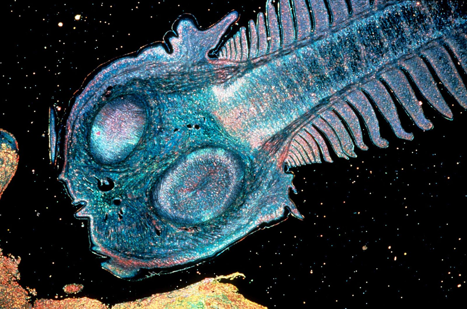 Anoplocephala perfoliata (tapeworm) in equine cecum | Nikon Small World