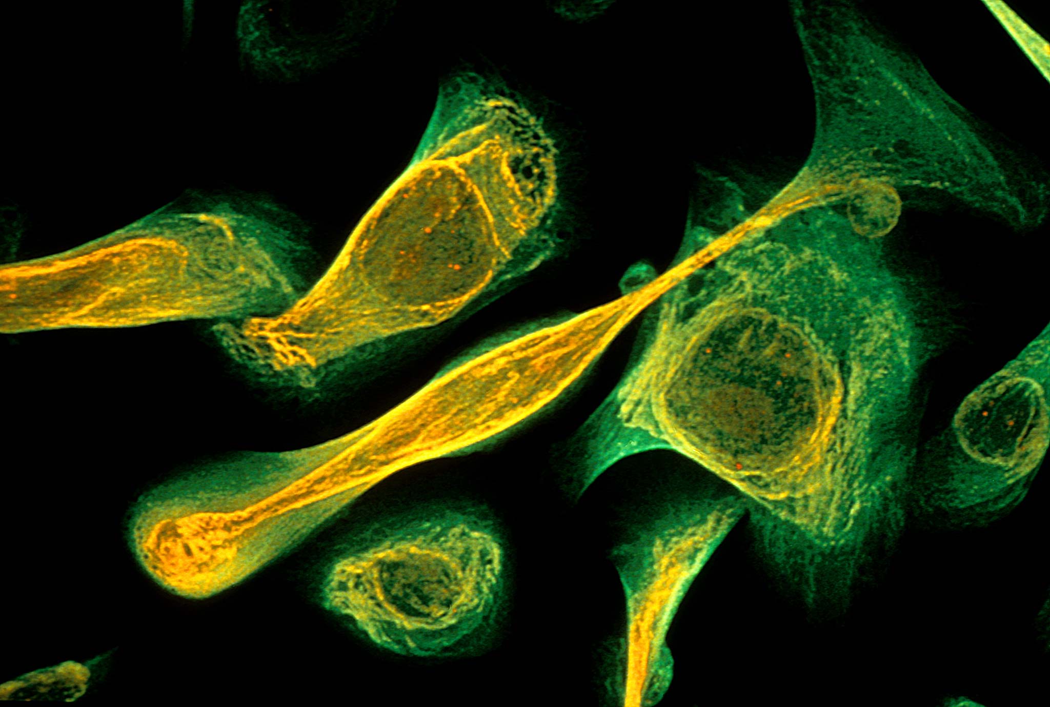 Human thymic epithelial cells stained for pan-cytokeratin (green) and ...