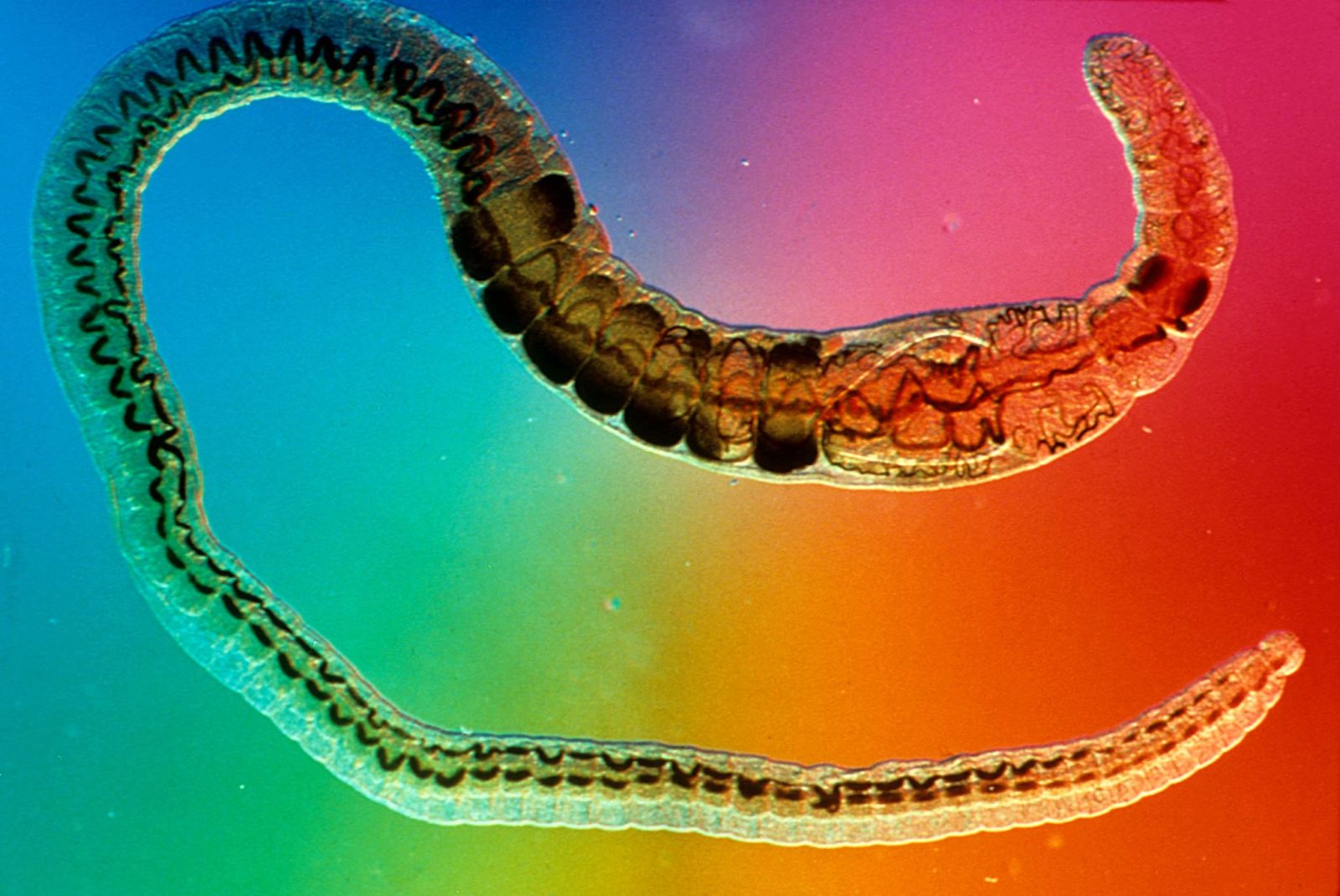 Oligochaete (water worm) | Nikon Small World